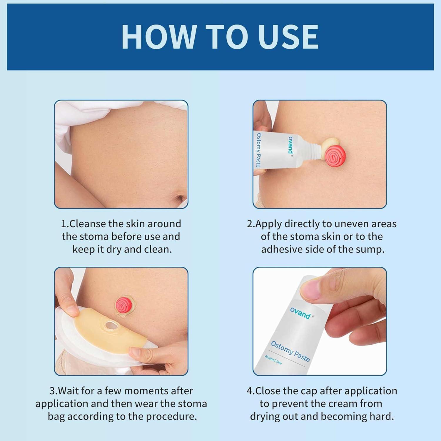 Buy Alcohol-Free Ostomy Paste | Skin Barrier for Stoma Care | Prevent ...