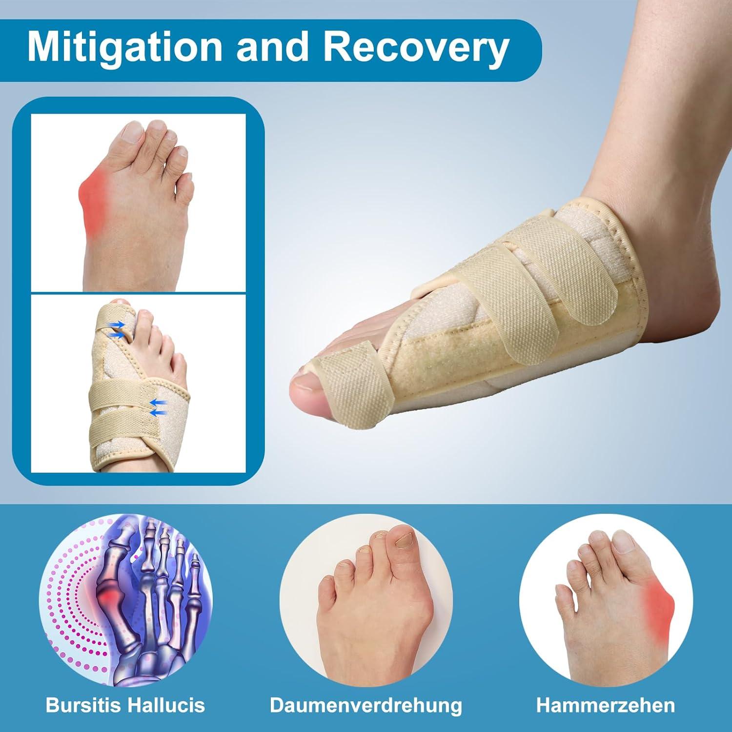 Hallux Valgus Correction Rail - Relief for Toe Pain & Alignment | Beige ...