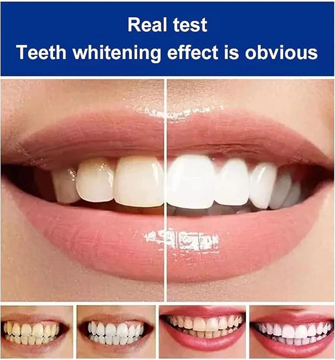 SP-4 Ultra Whitening Toothpaste | Probiotic Fresh Breath Formula ...