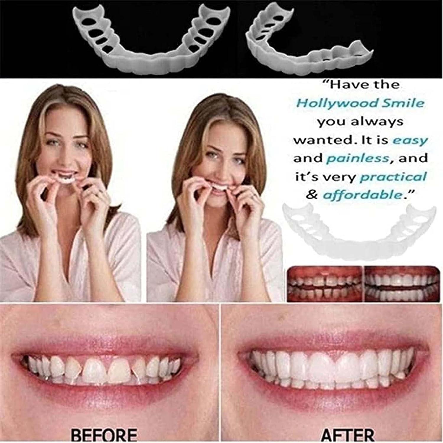 Asiacreate Temporary Dentures Kit - Customizable Smile Teeth Veneers ...