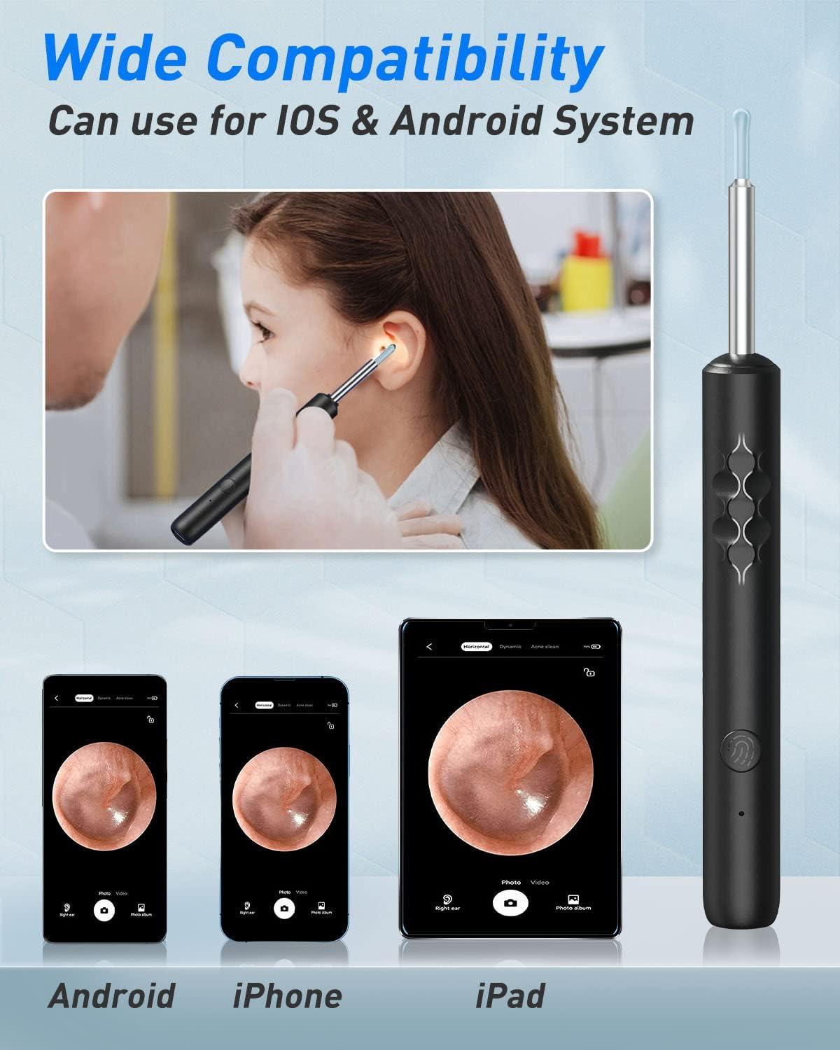 1080P HD Wireless Ear Wax Removal Kit with 6 LED Lights & 3 Curved Ear ...