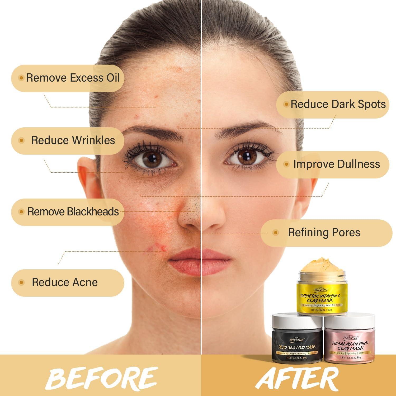 Clay Mask Kit Turmeric Vitamin C Clay Mask Dead Sea Mud Mask Himalayan ...