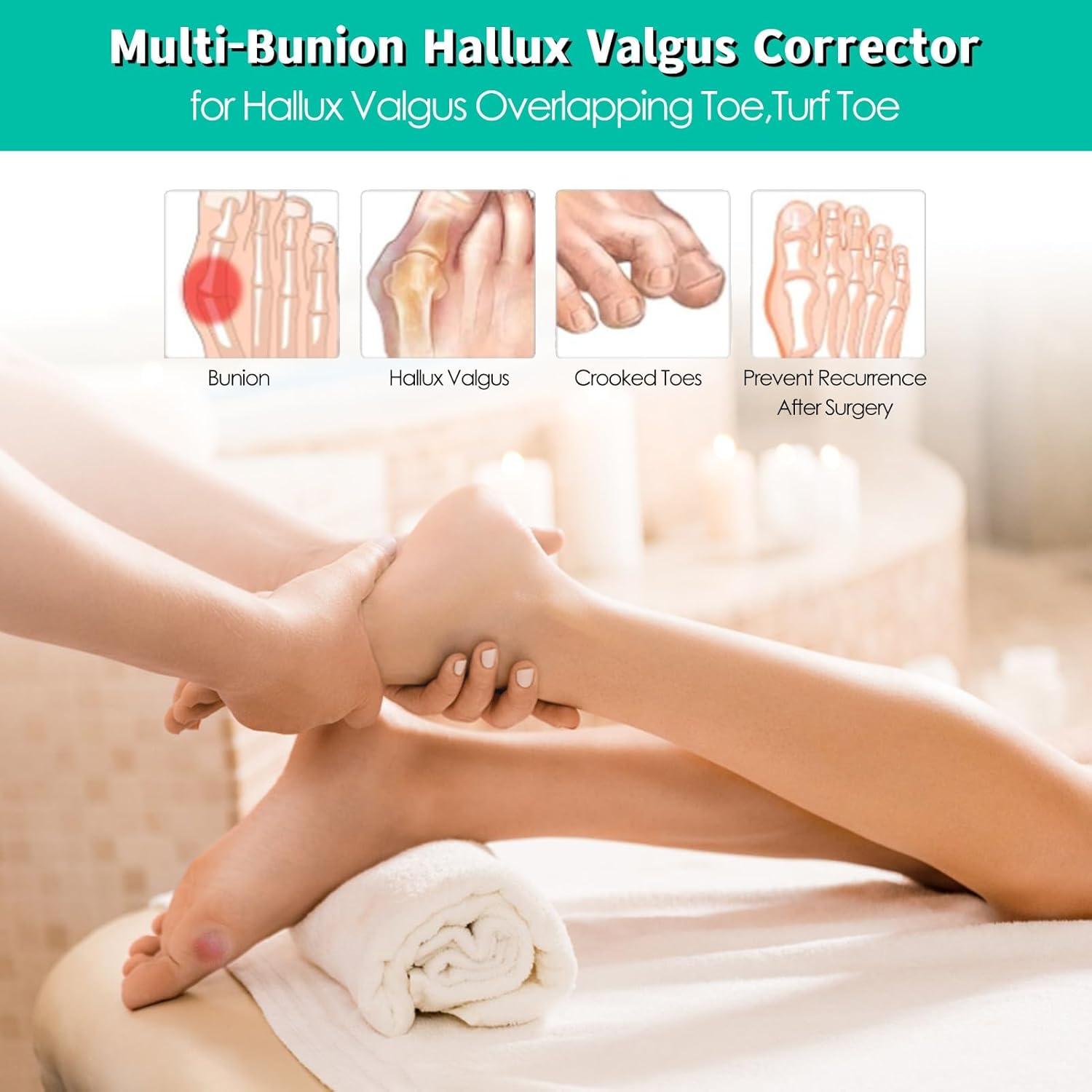 Kireina Bunion Relief Corrector - Nighttime Toe Separator for Hallux ...