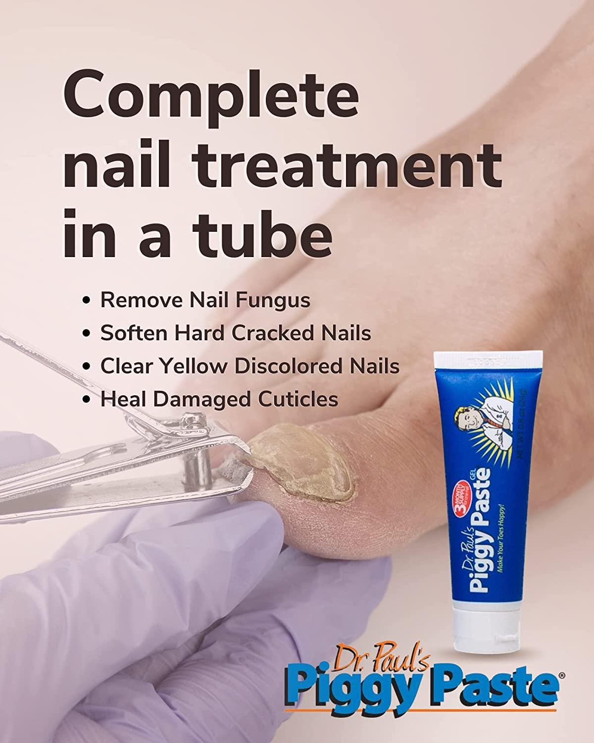 Piggy Paste Toe Nail Fungus Treatment by Dr. Paul - Restores Brittle ...