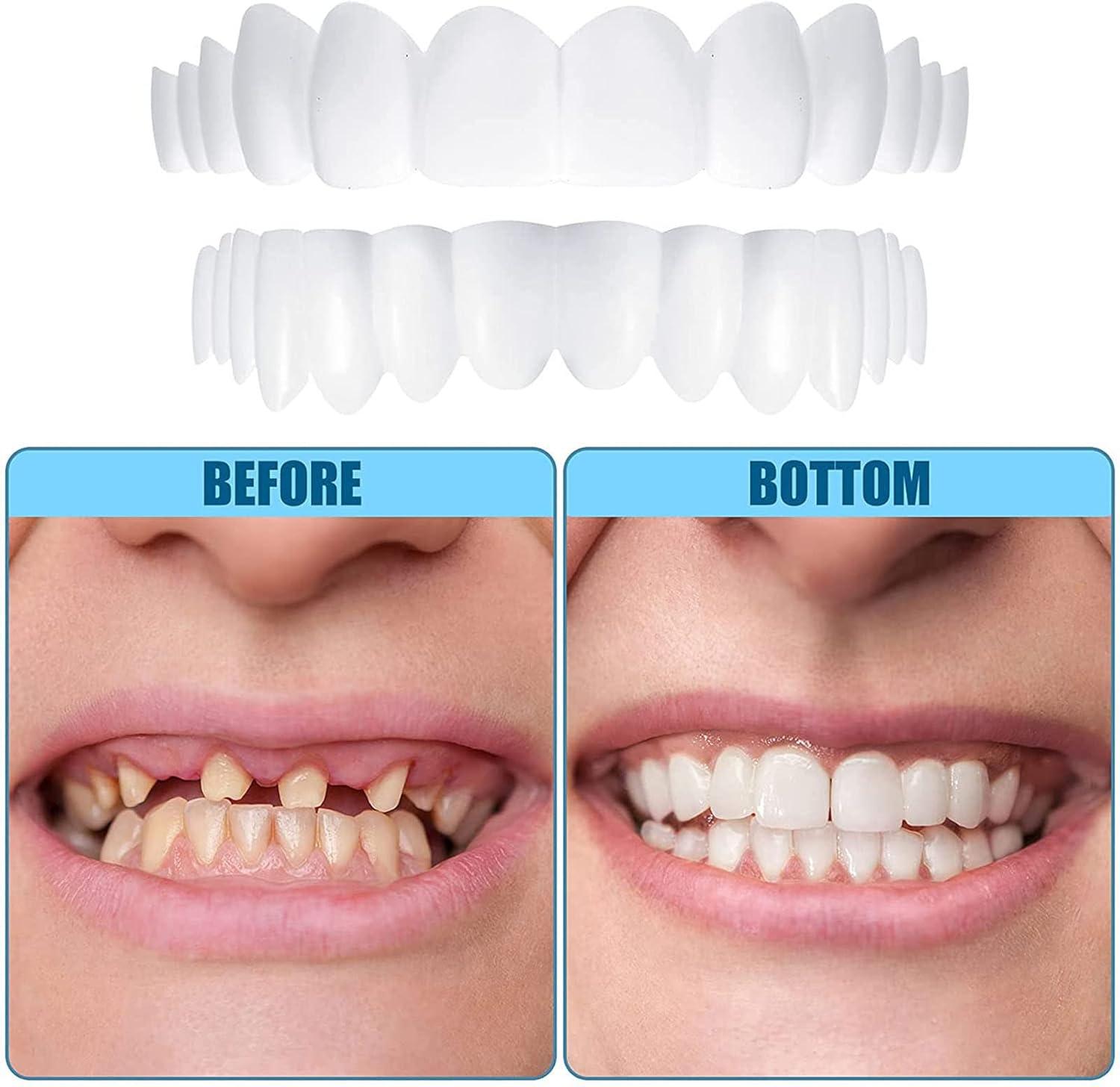 Mxrfactory Teeth Prosthesis Pebble Gel Snap-On Smile - Temporary ...