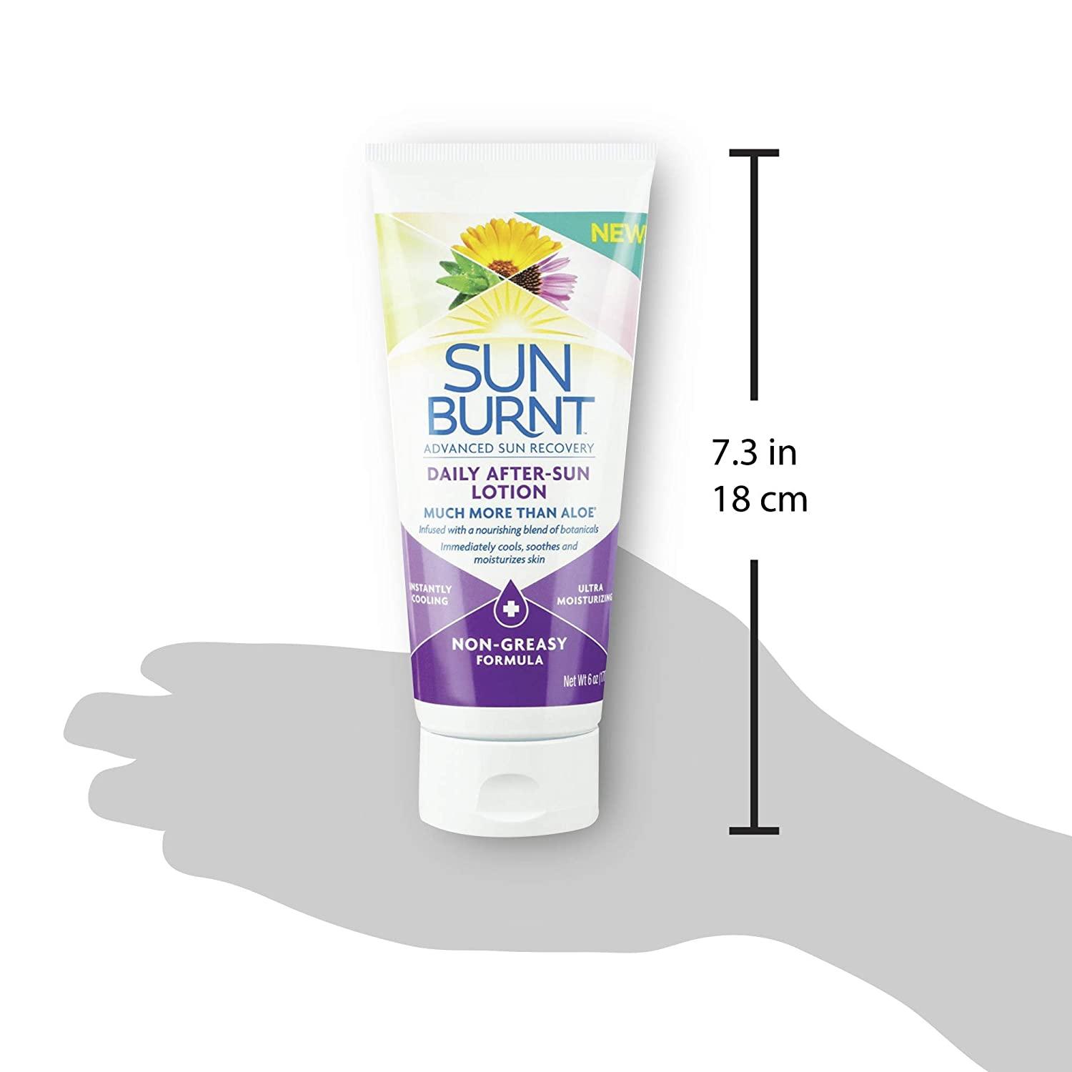 Sunburnt Advanced After-Sun Lotion 6oz - Soothing Relief for Sunburned ...