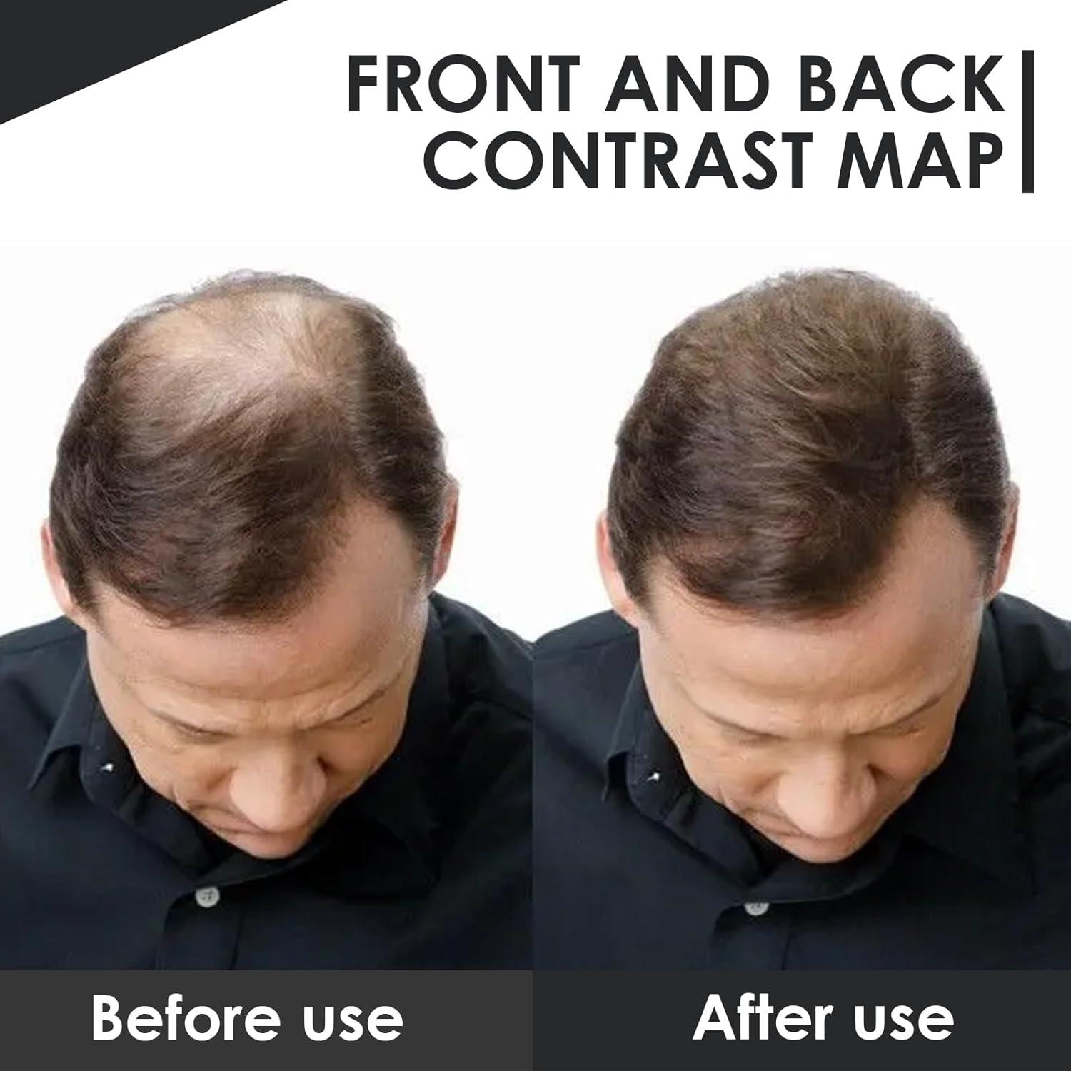 Buy Medium Brown Hair Scatter for Full Dense Look | Hair Compression ...