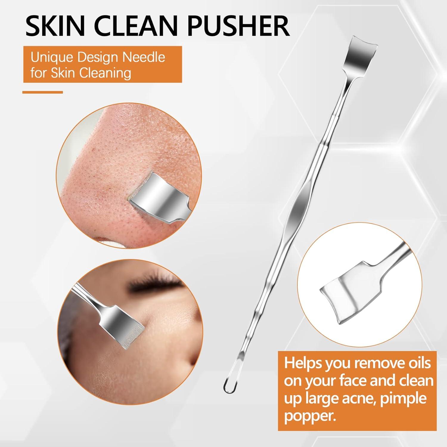 Professional Blackhead Remover Pimple Popper Tool Kit for Acne Removal ...