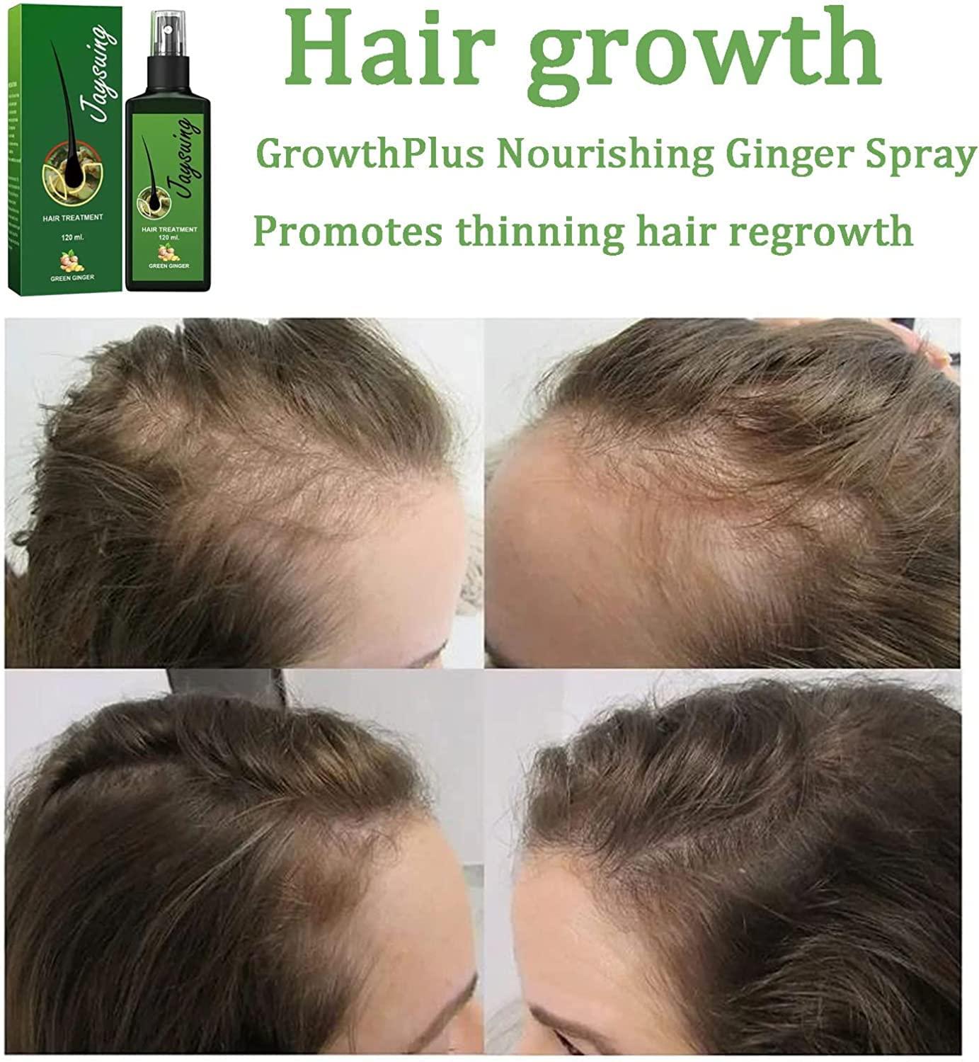 GrowthPlus Nourishing Ginger Spray - Promotes Hair Growth for Women ...