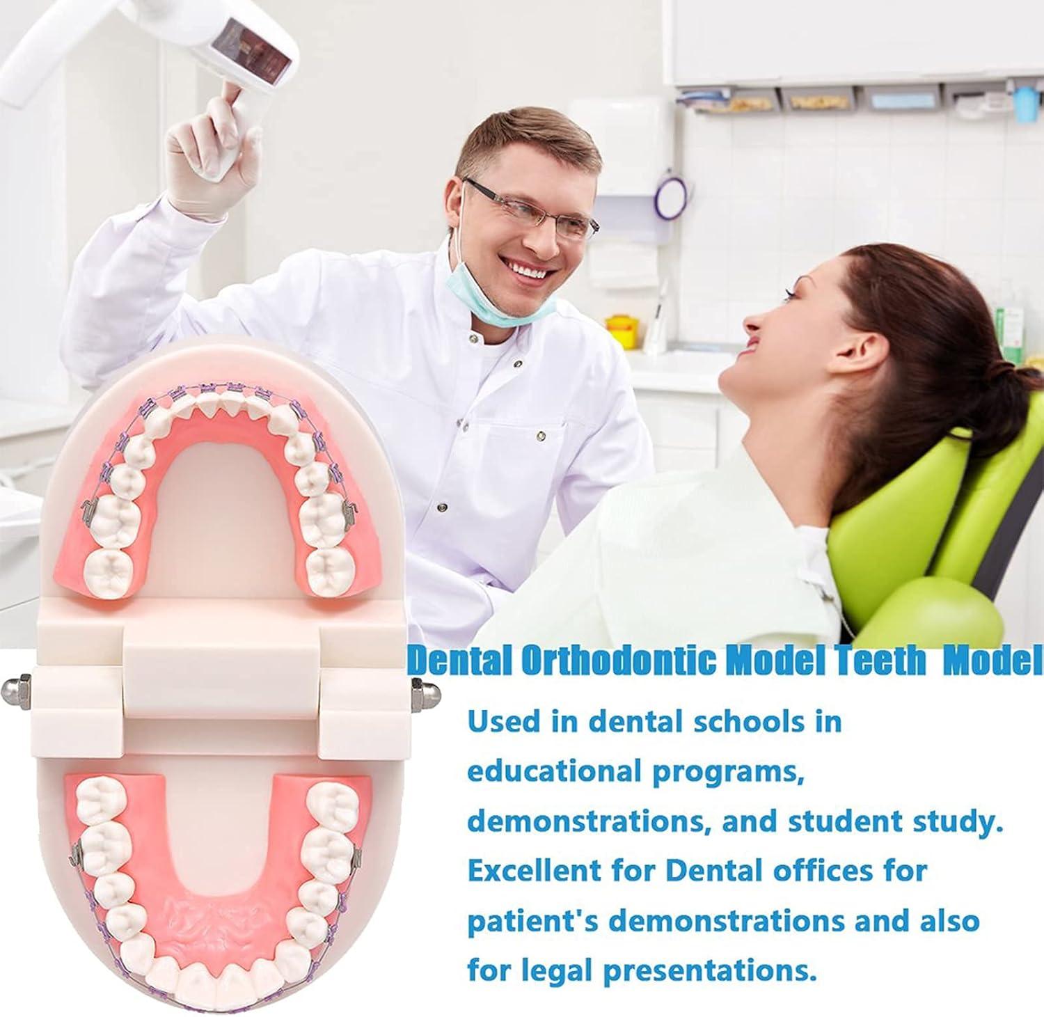 Dytah Orthodontic Demonstration Model - Teeth Study Model with Metal ...