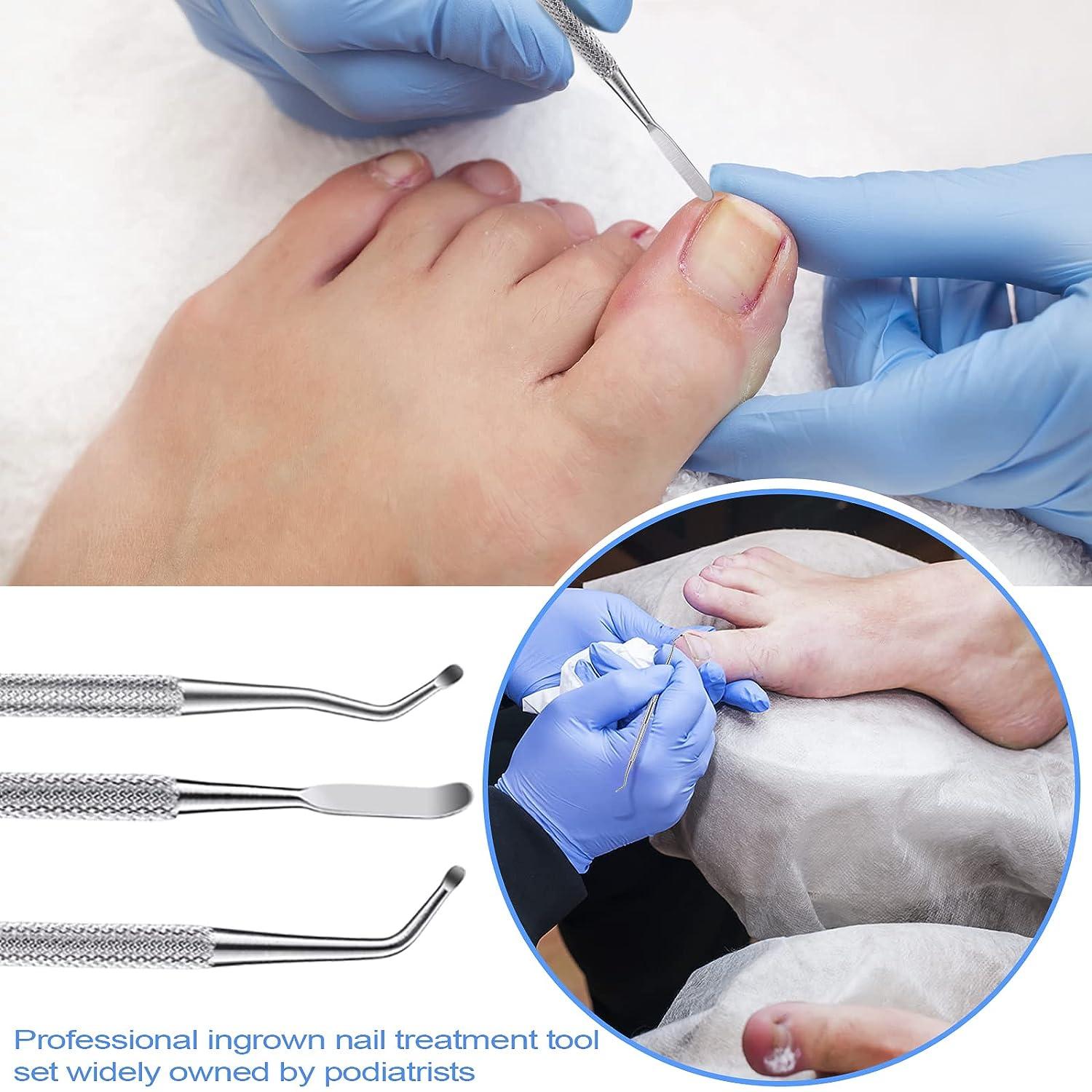 Ingrown Toenail Removal Kit - 10PCS Surgical Stainless Steel Tools for ...