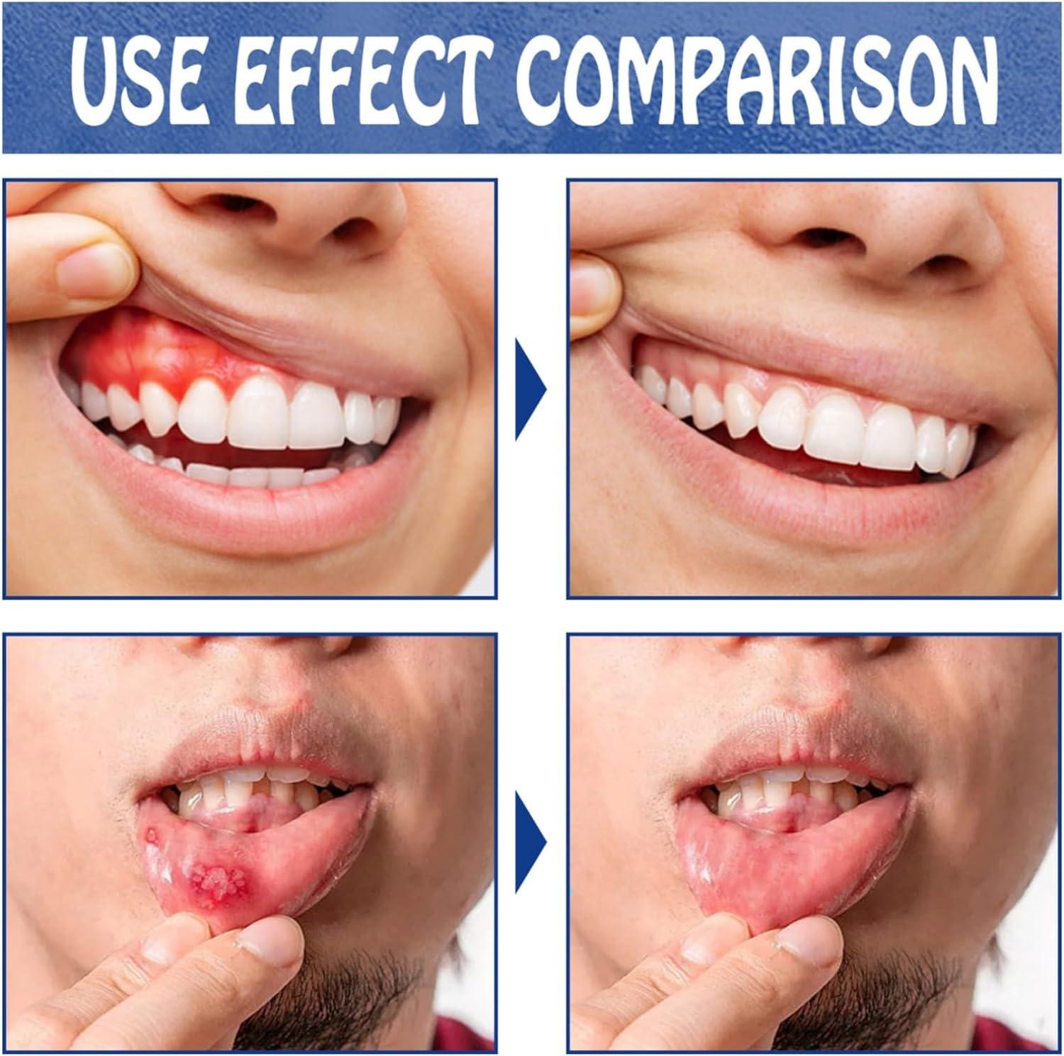 Toothache Relieving Spray Oral Care Spray Rapid Relief Dental Spray ...