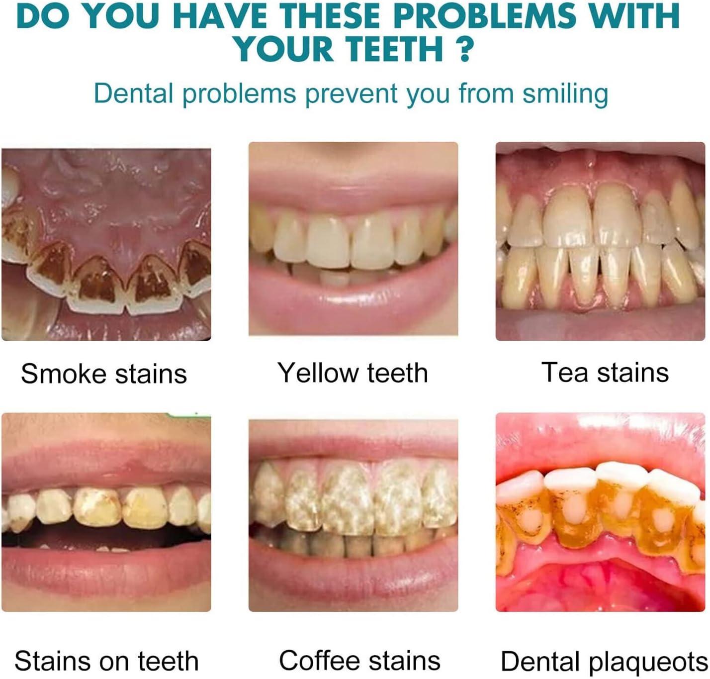 Instant Teeth Whitening Color - Upright White Tooth Polish 15ml ...