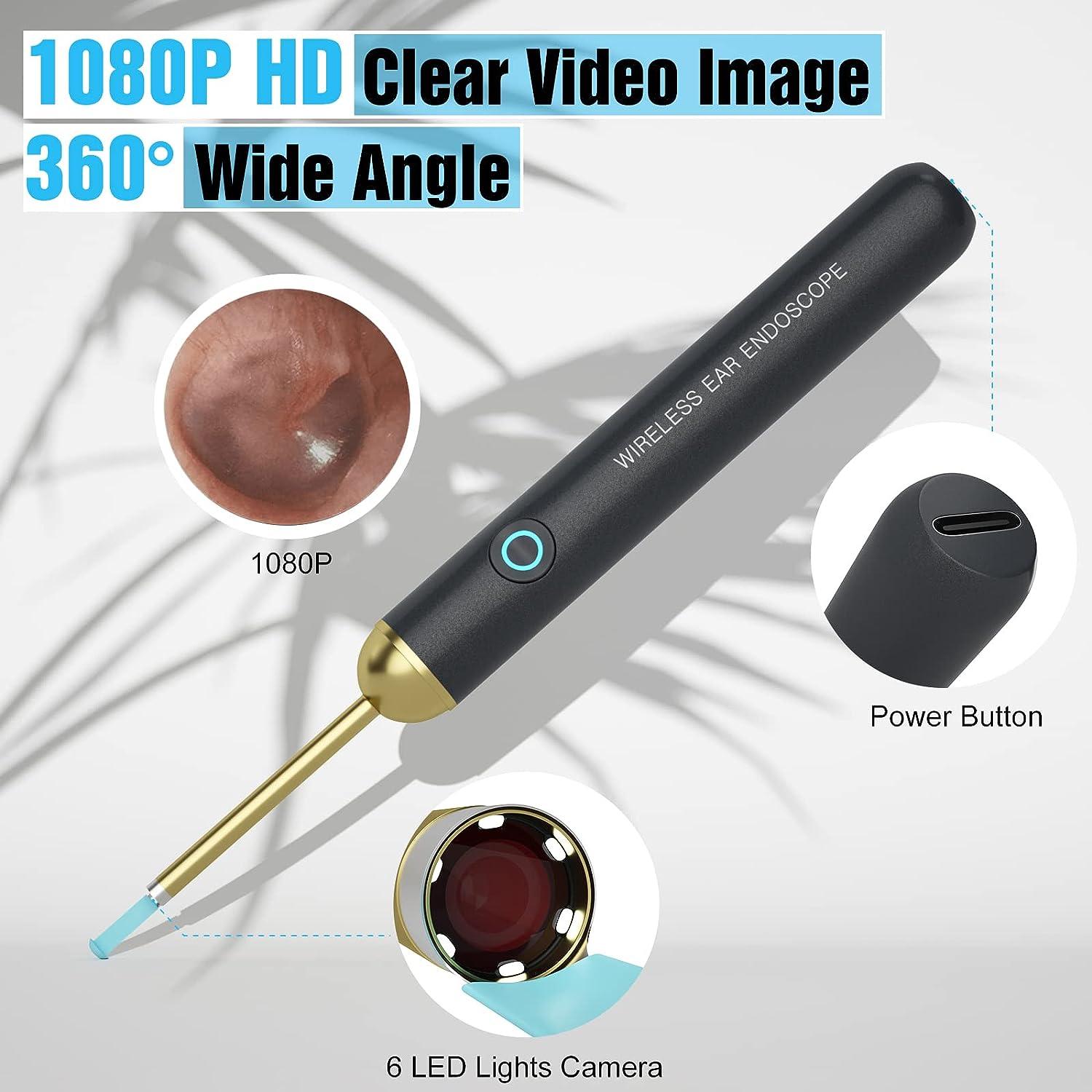 NIUQICT Ear Cleaner - 1080P Ear Camera with Lights - Ear Wax Removal ...