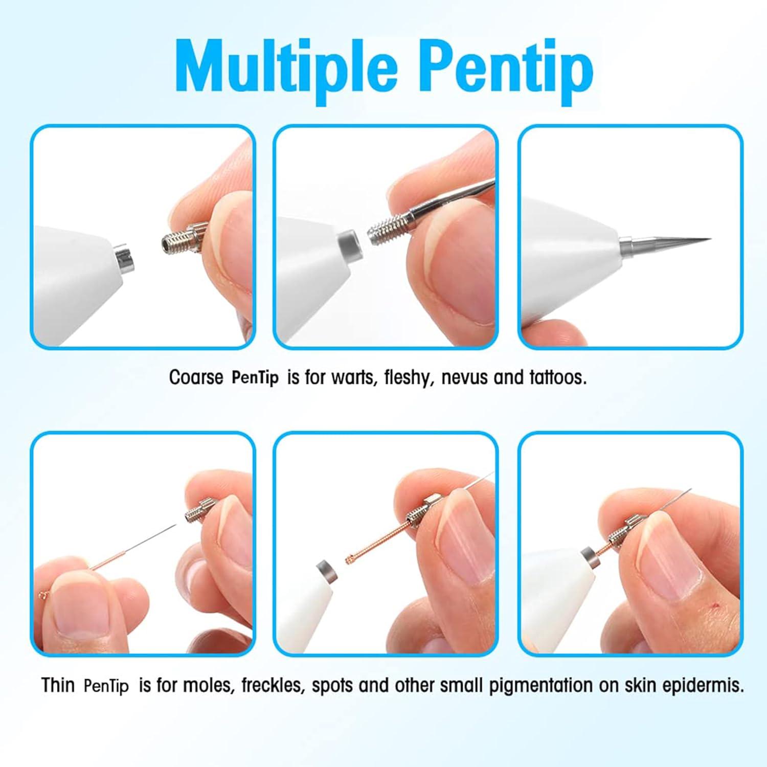LARALA Skin Tag Removal Pen Skin Tag Removal Kit Mole Remover with 9 ...