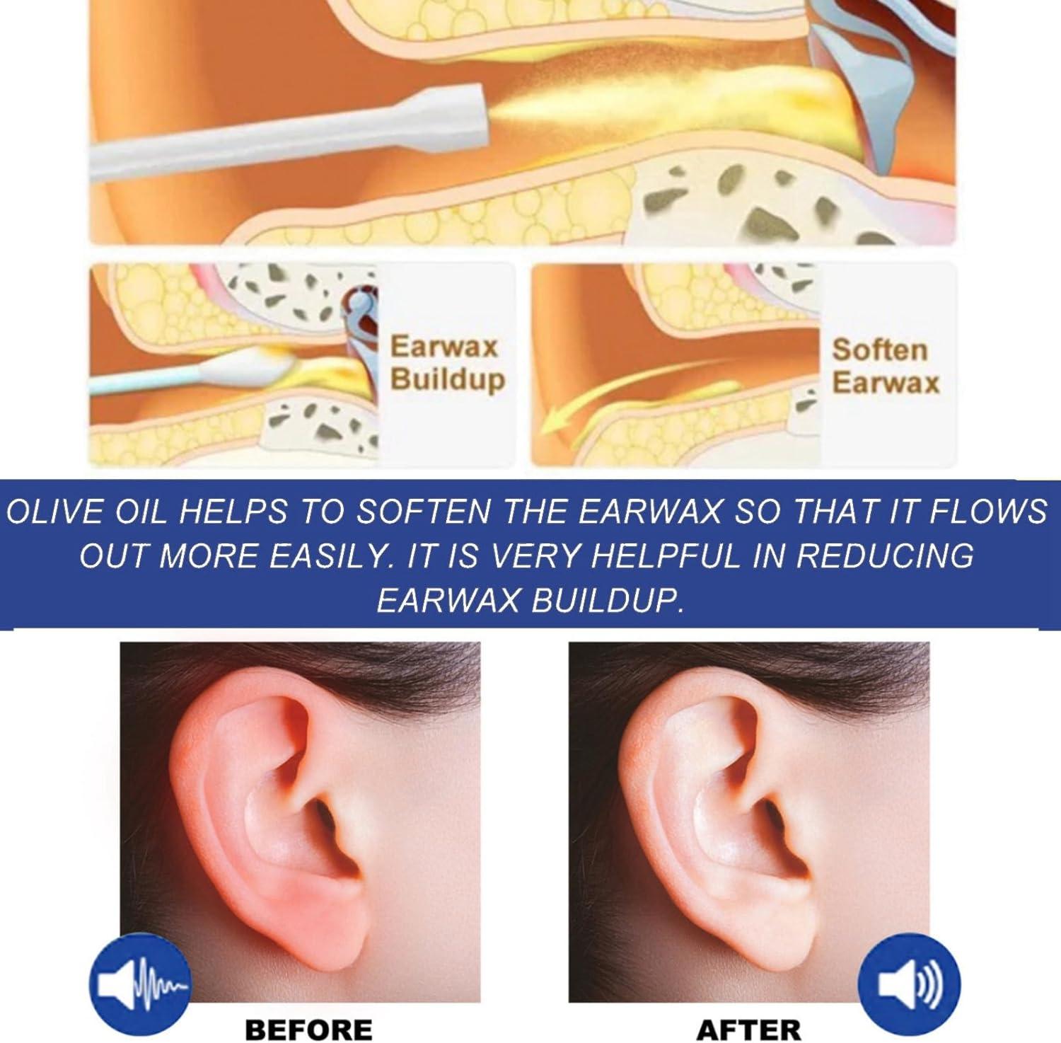 Tinnidrop Tinnitus Relief Spray Ear Tinnitus Sprays Ear Ringing Spray ...