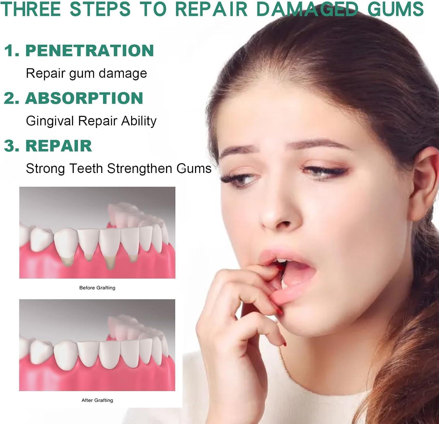 Buy Gum Regrowth Drops Repair & Regenerate Gums | 30ml Gum Casting ...