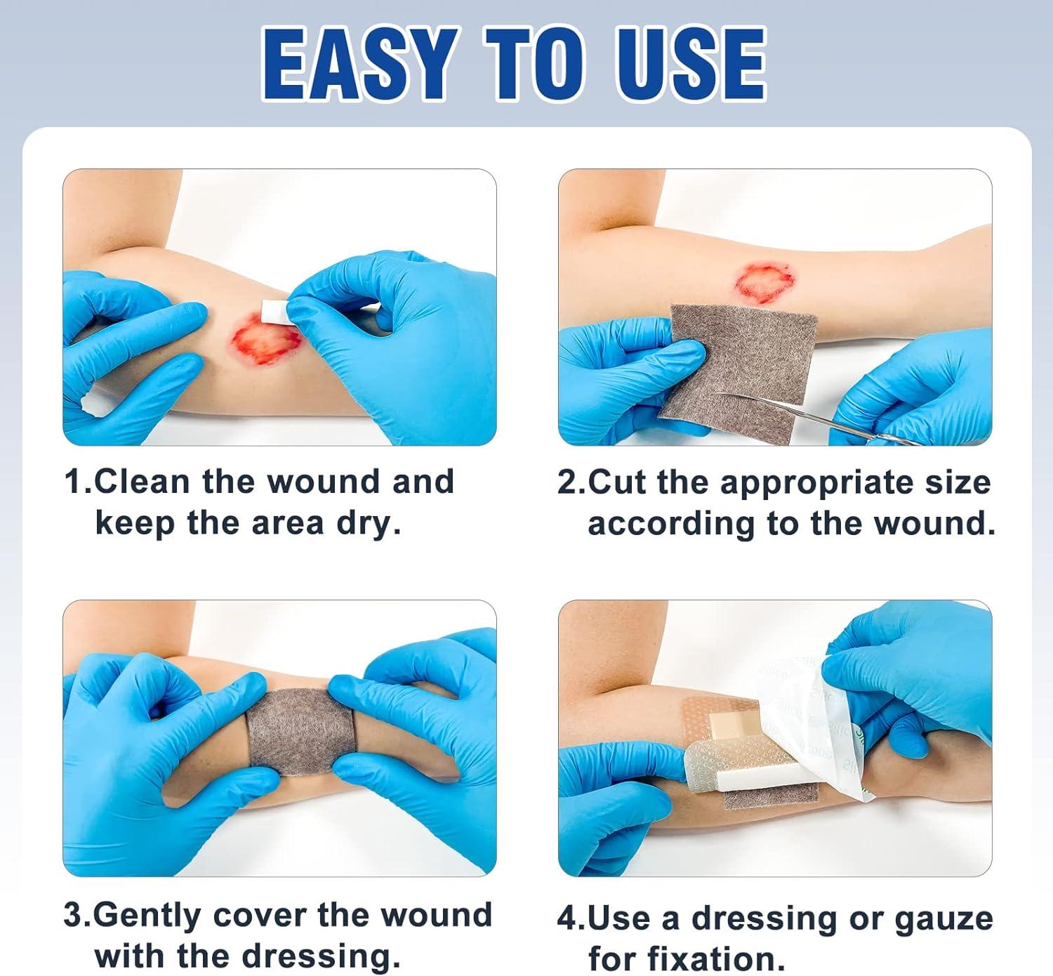 Ag Silver Calcium Alginate Wound Dressing Pads 3'' x 3'' - 10 Pack ...