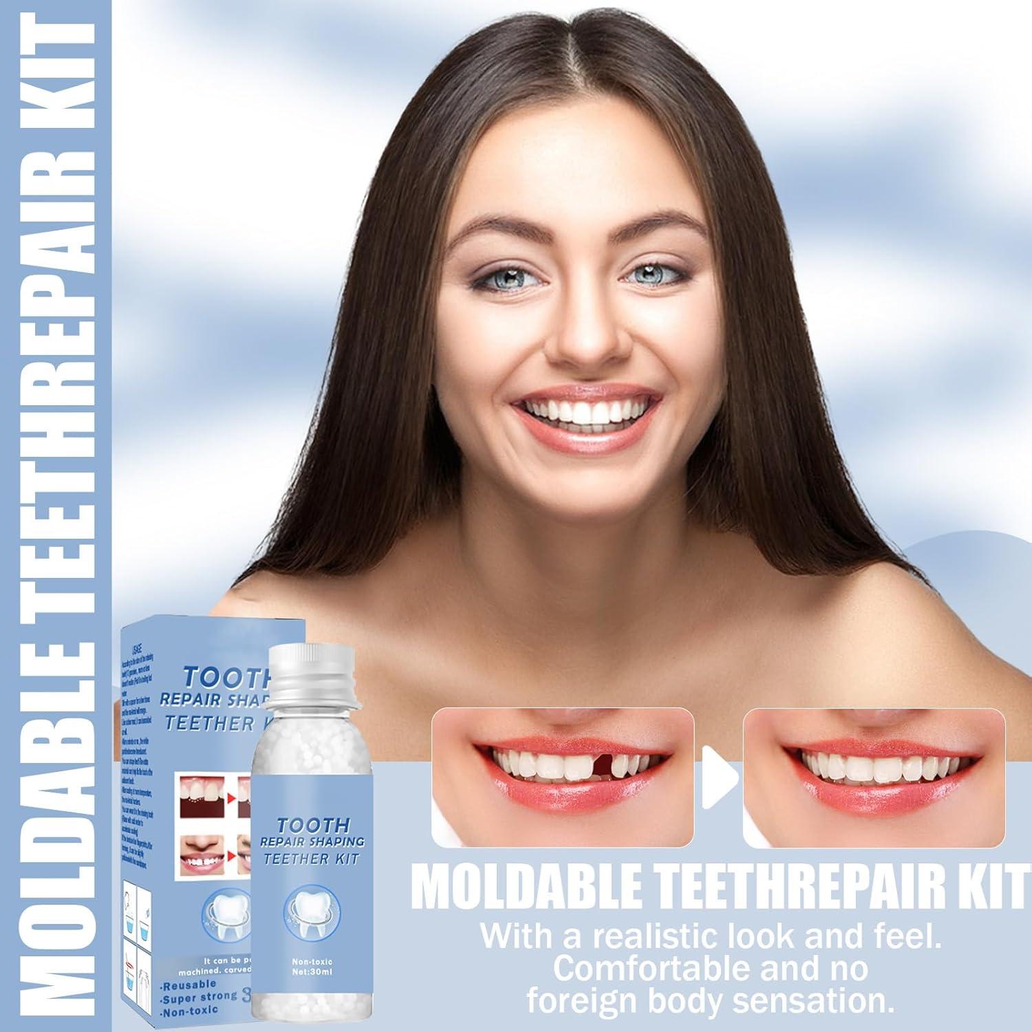 Temporary Dentures & Dental Repair Kit | Provisional & Adhesive Fake ...