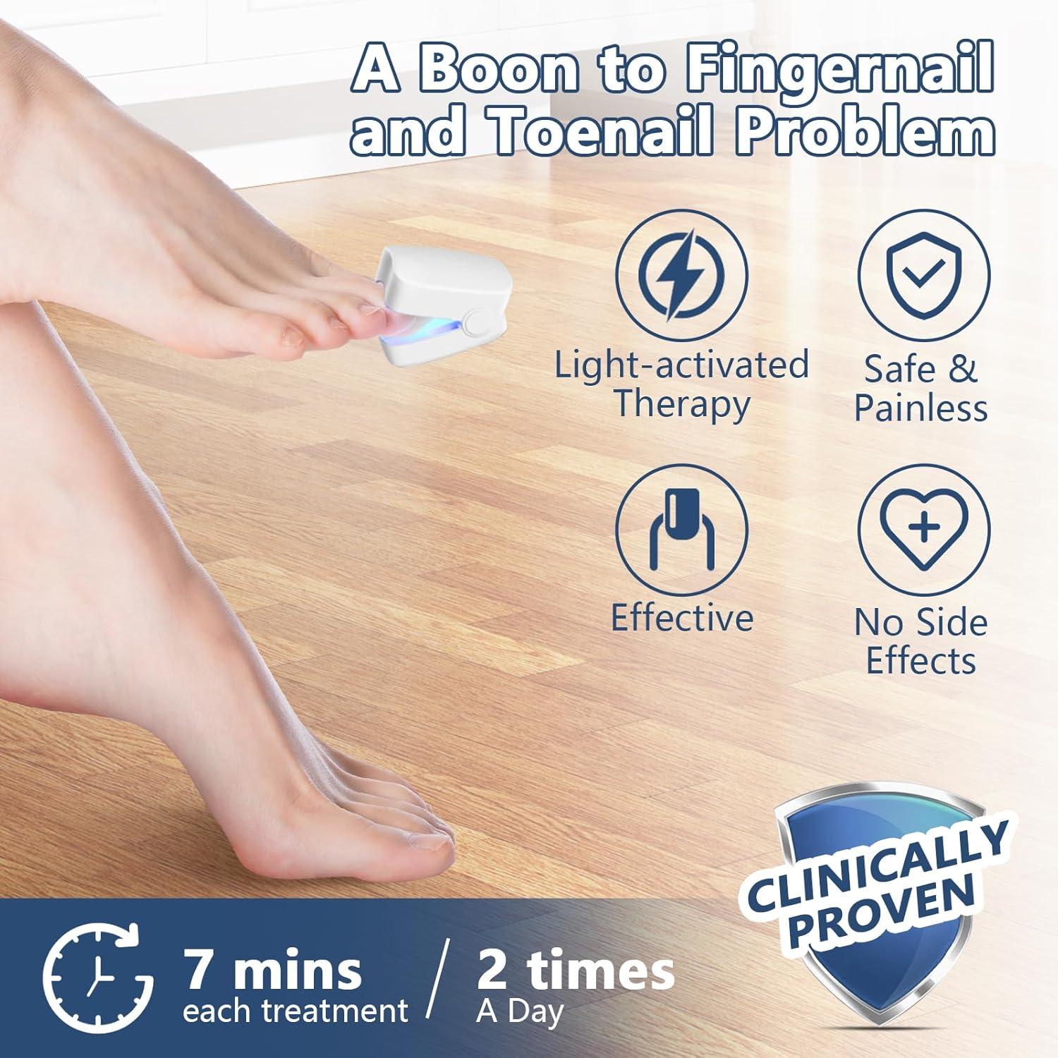 Toenail Fungus Cleaning Device - Heal Discolored & Thick Nails Fast ...