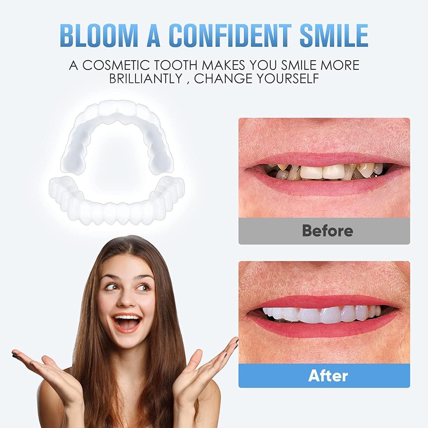 Instant Perfect Smile: Cosmetic Teeth Veneers & Snap-On Dentures for ...