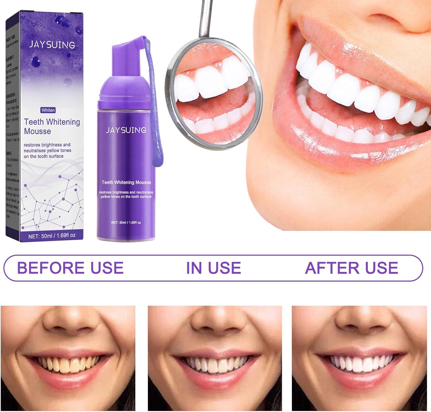 Purple Toothpaste for White Teeth | Teeth Whitening Booster & Color ...