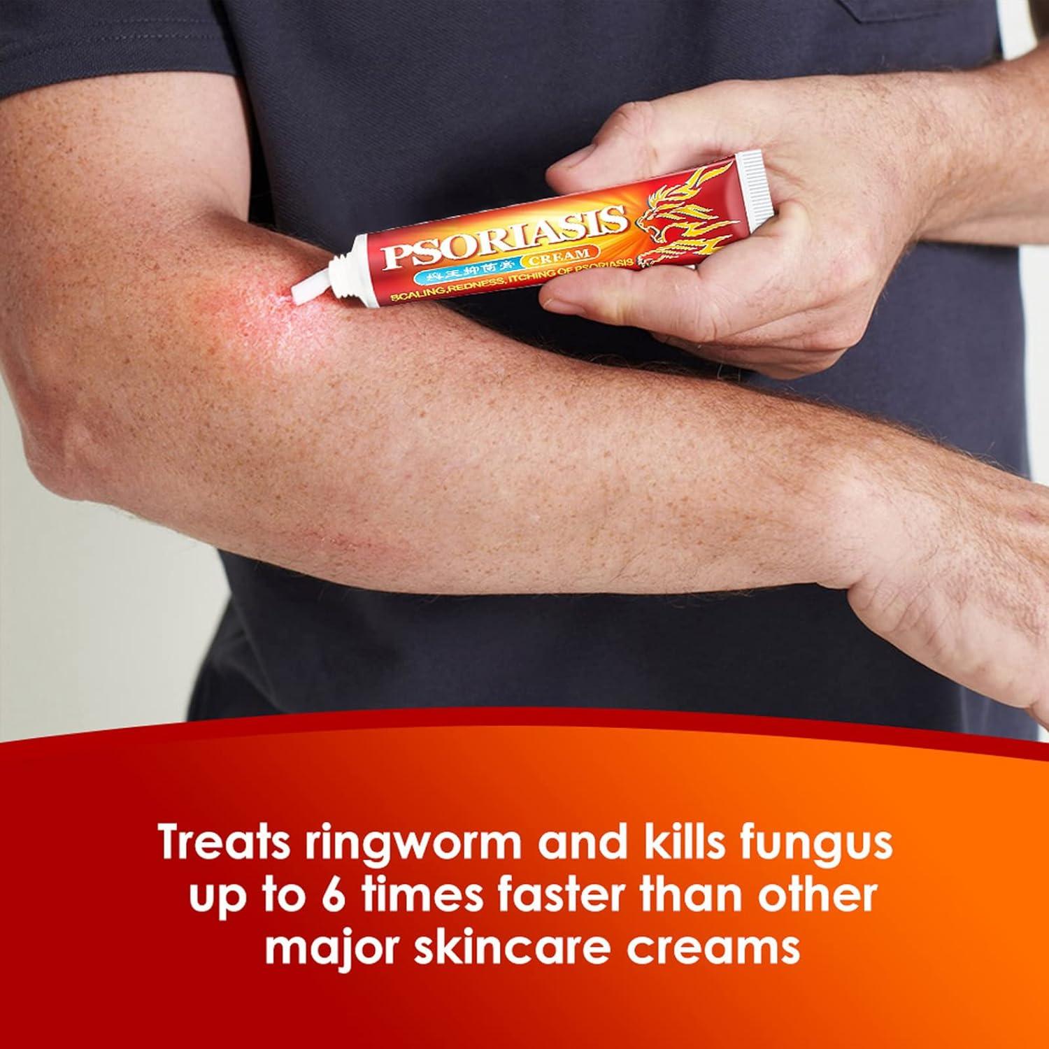 Skin Soothing Cream for Dry, Itchy & Irritated Skin - 20g | Buy Now in ...