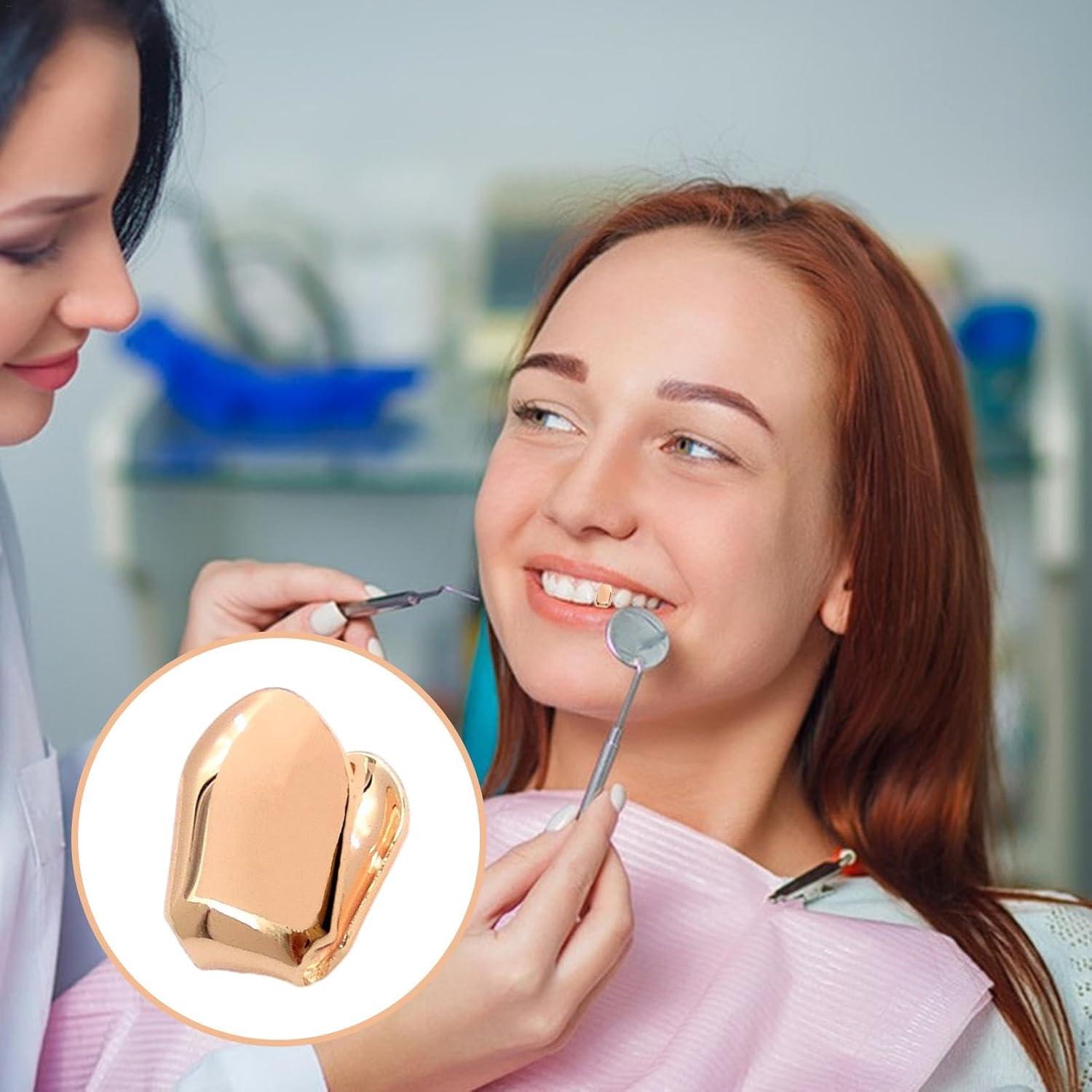 Single Gold Tooth Cap - 14k Gold Realistic Fake Teeth Grills Gold ...