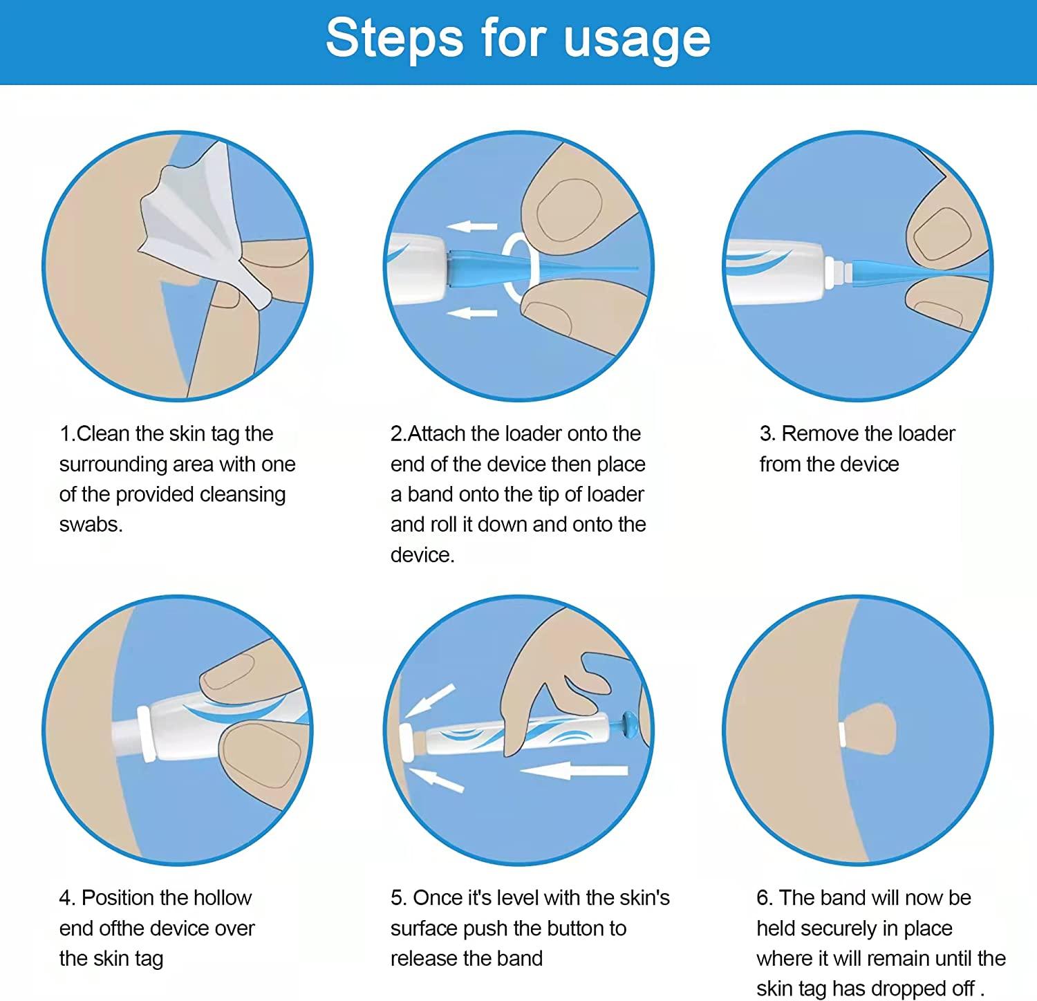 Kelinul 2-in-1 Skin Tag Remover Pen | Safe & Painless Removal | 40 Skin ...