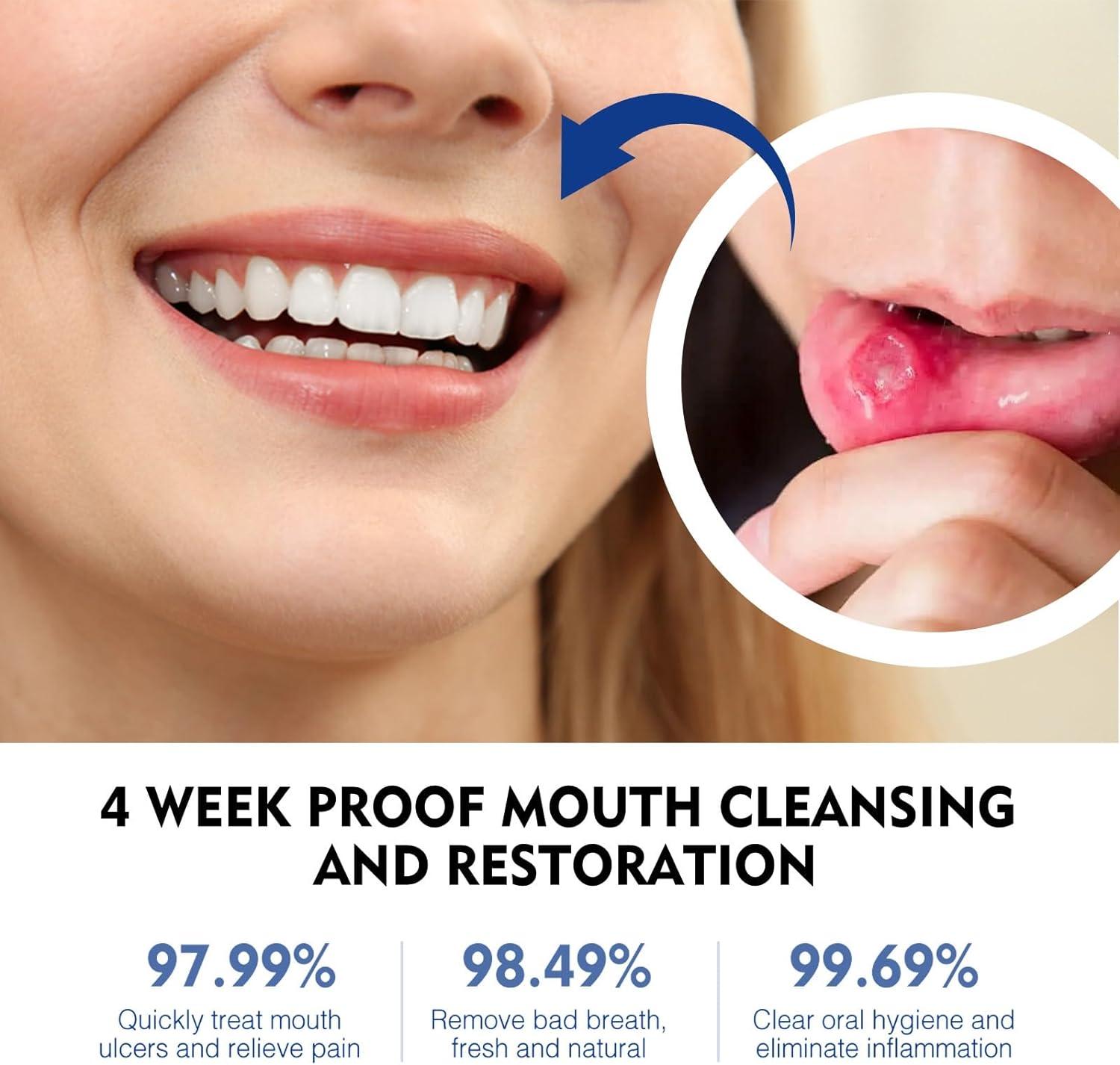 Mouth Ulcer Treatment Spray Mouth Ulcer Spray Ulcer Breath Sprays Oral ...