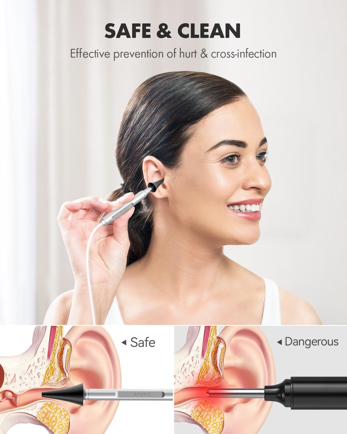 Anykit Digital Otoscope Replacement Tips - Set of 100 Ear Specula ...