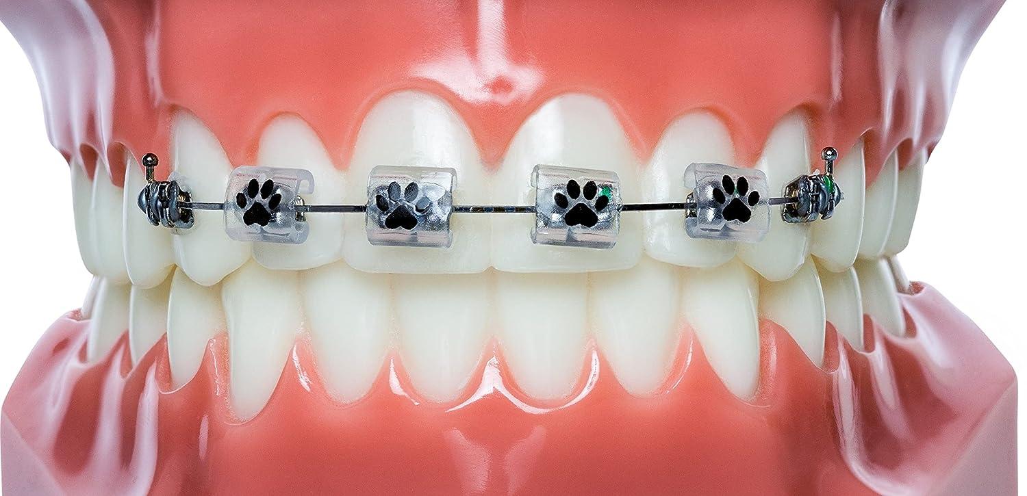 Snapcaps Paw Print 10 Ct: Bracket Cover Bumper for Braces - Orthodontic ...