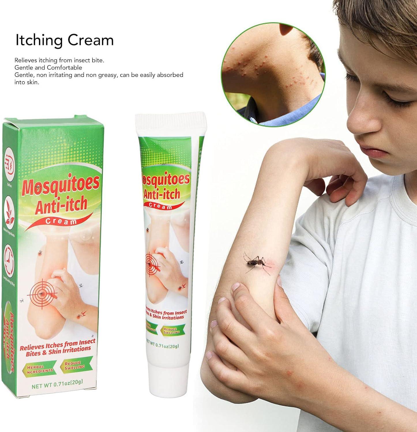 20g Anti-Itch Ointment for Soothing Relief and Comfortable Skin ...