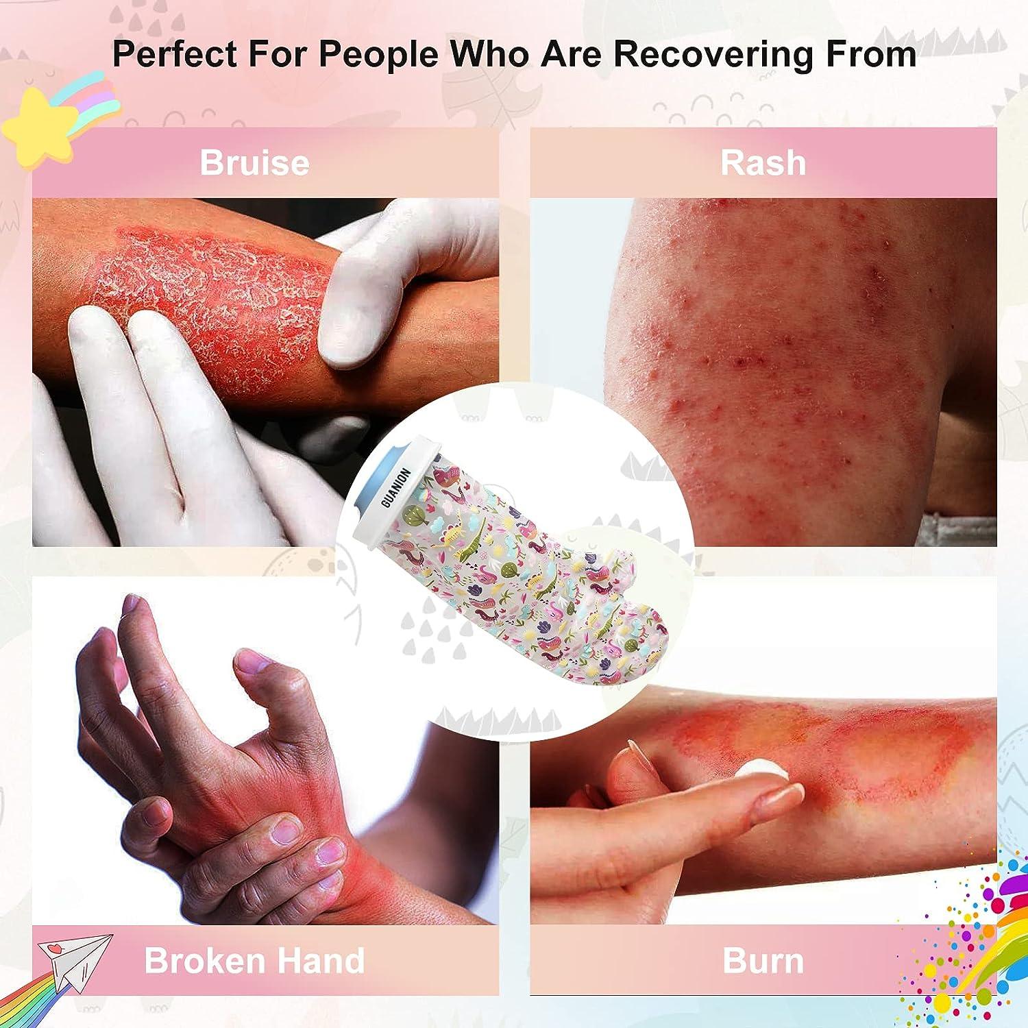 Kids Waterproof Arm Cast Cover for Shower - Reusable Protector for ...