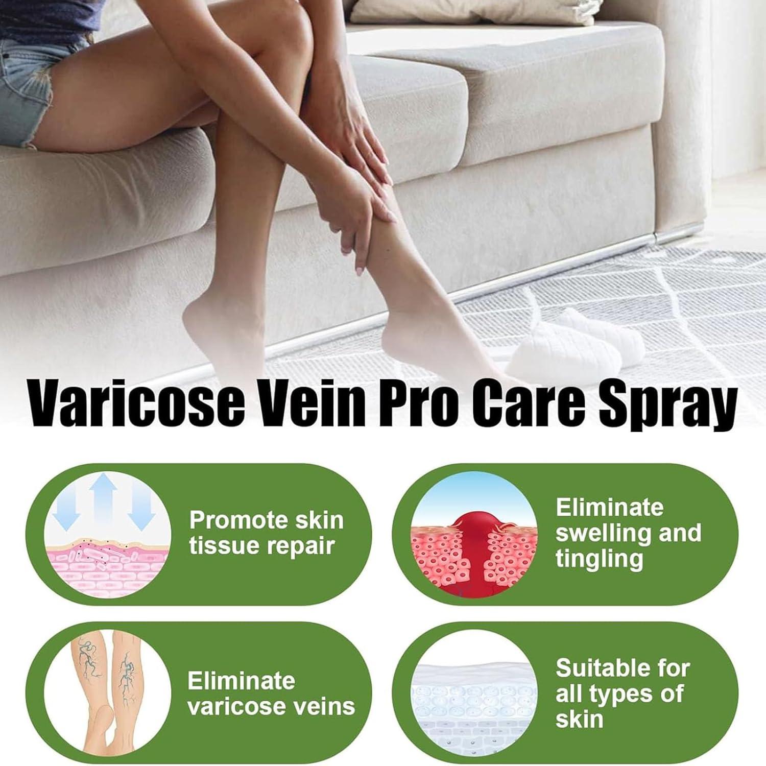 Varicose Veins Xpert Spray | Effective Treatment & Relief for Legs ...
