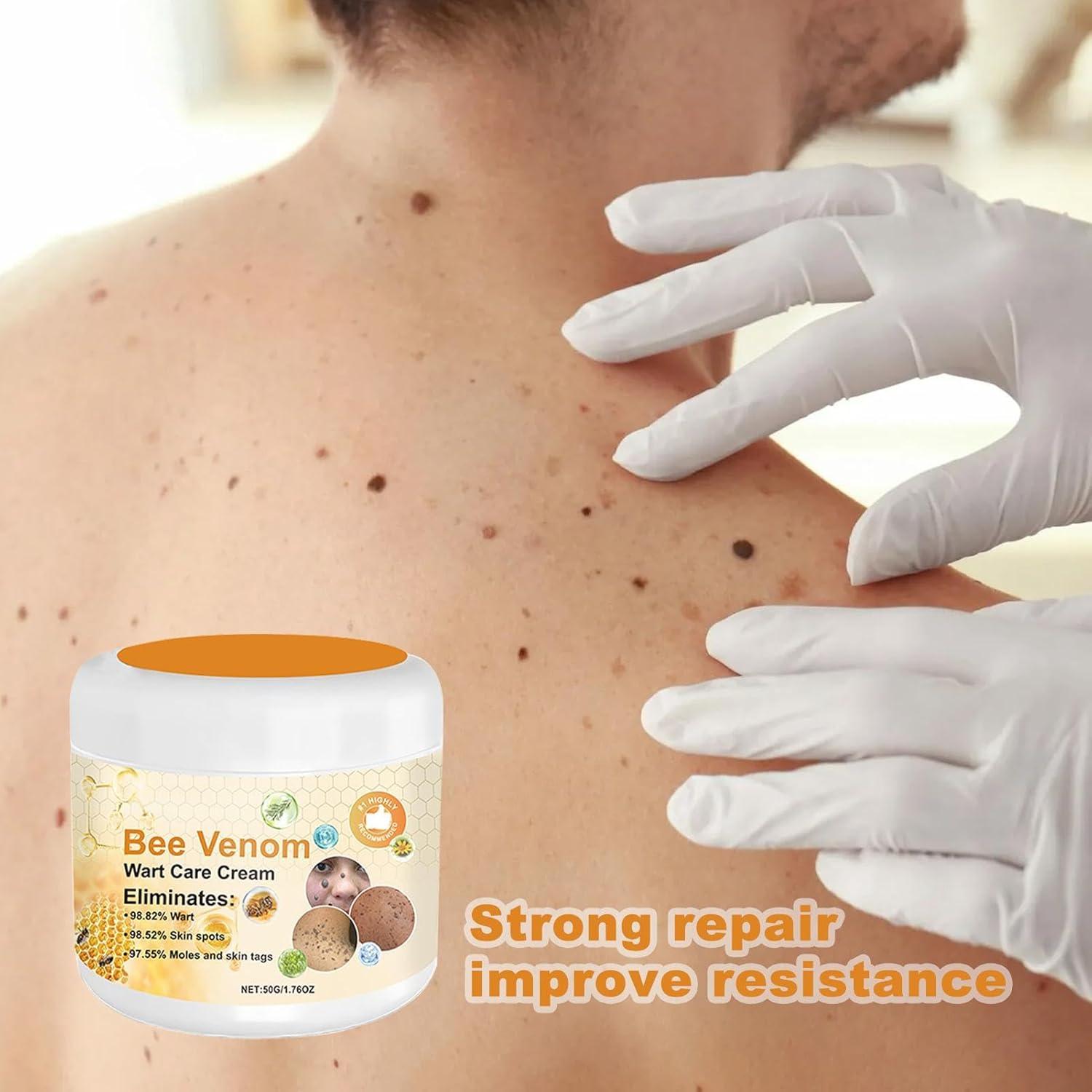 Bee venomm Wart and Tag Remover - Deep Nourishing Bee venomm Repair ...