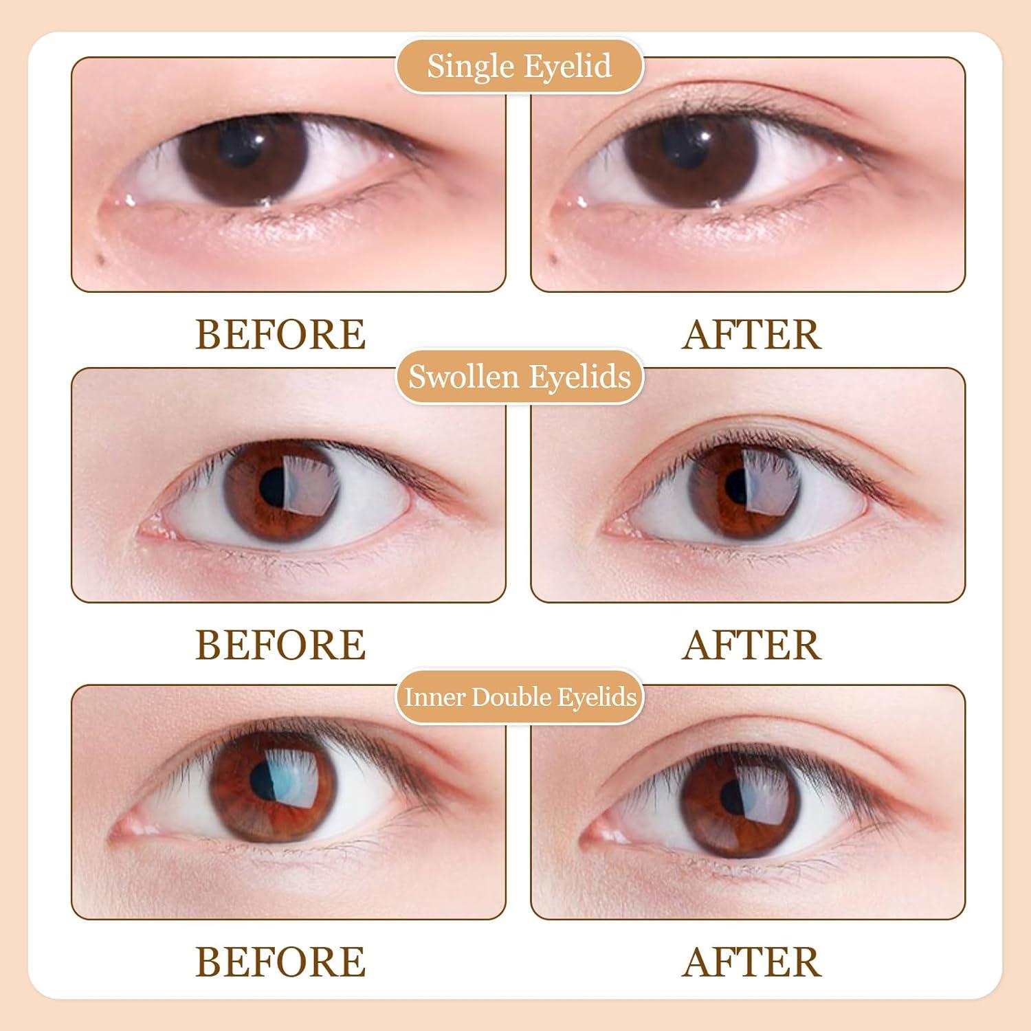 QJFHURB 120PCS Invisible Double Eyelid Tape - Eyelid Lift Strips with 2 ...