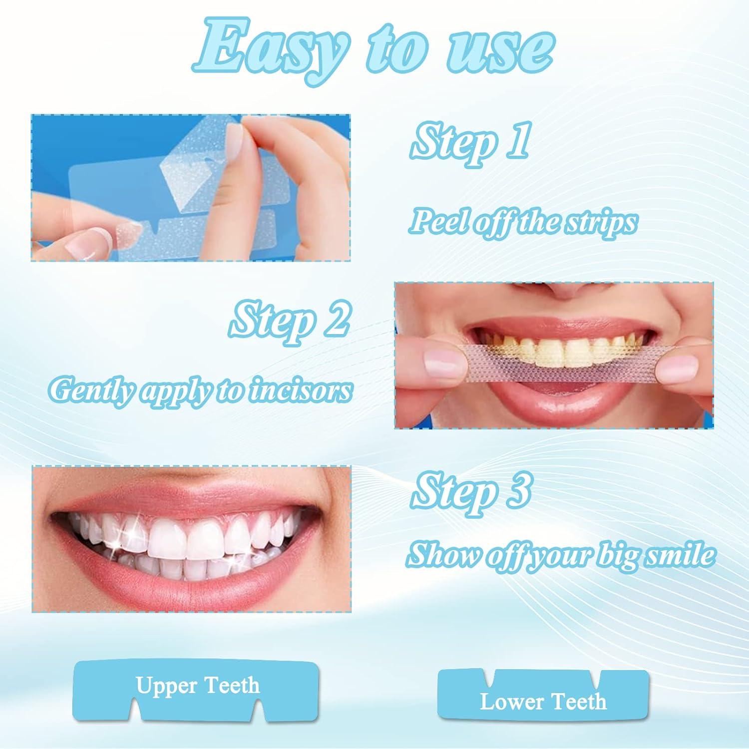 4-Piece Tooth Rail Crunch Set | Comfortable Nighttime Bite Protection ...