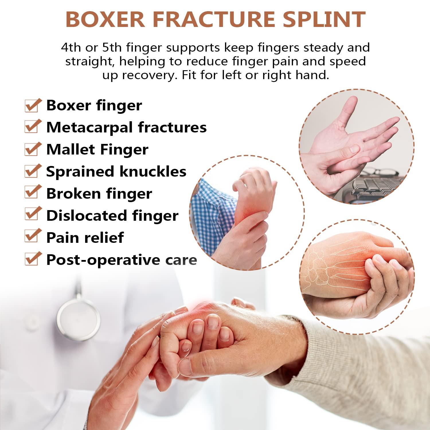 Broken Pinky Finger Splint
