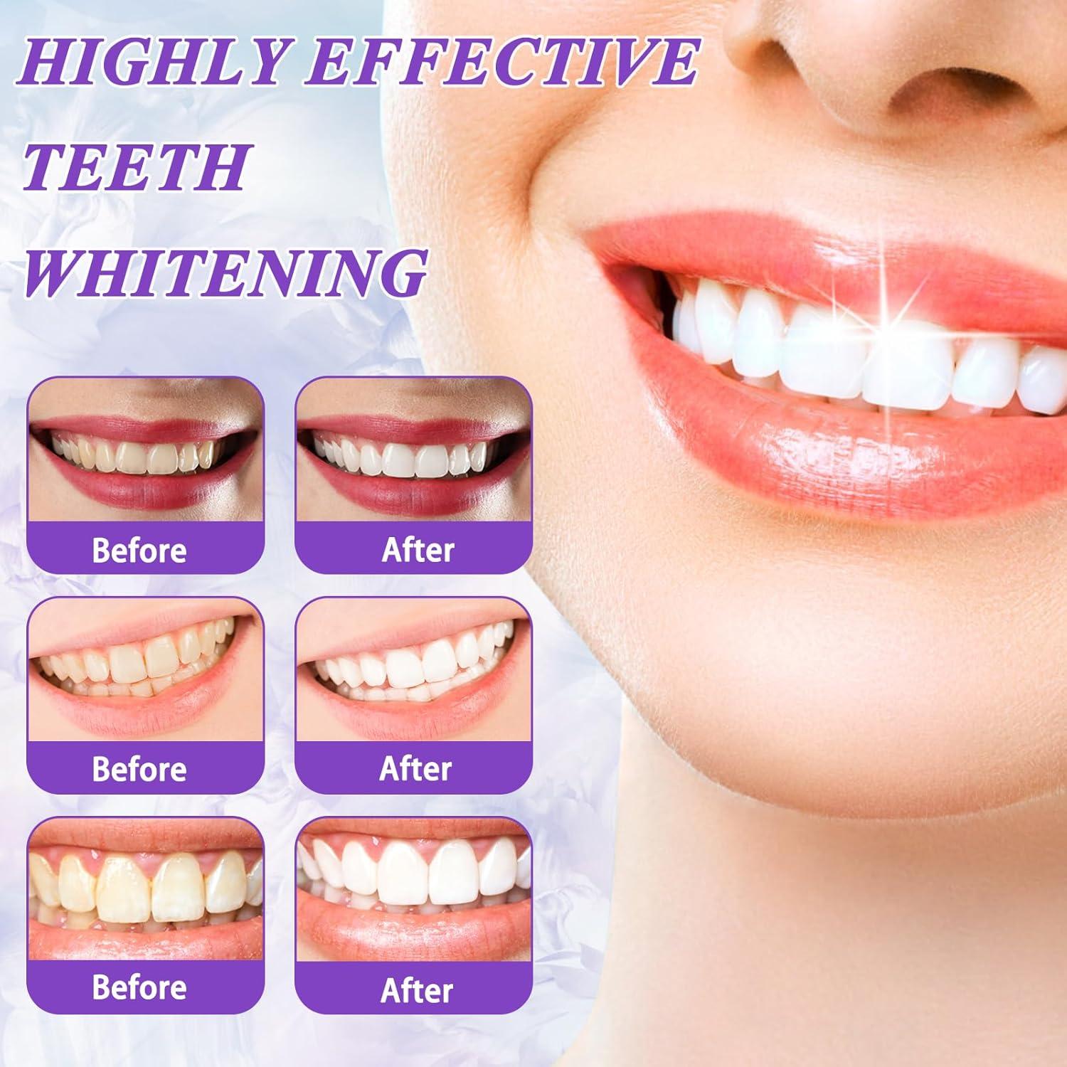 IJGD Purple Toothpaste - Color Corrector for Whiter Teeth ...