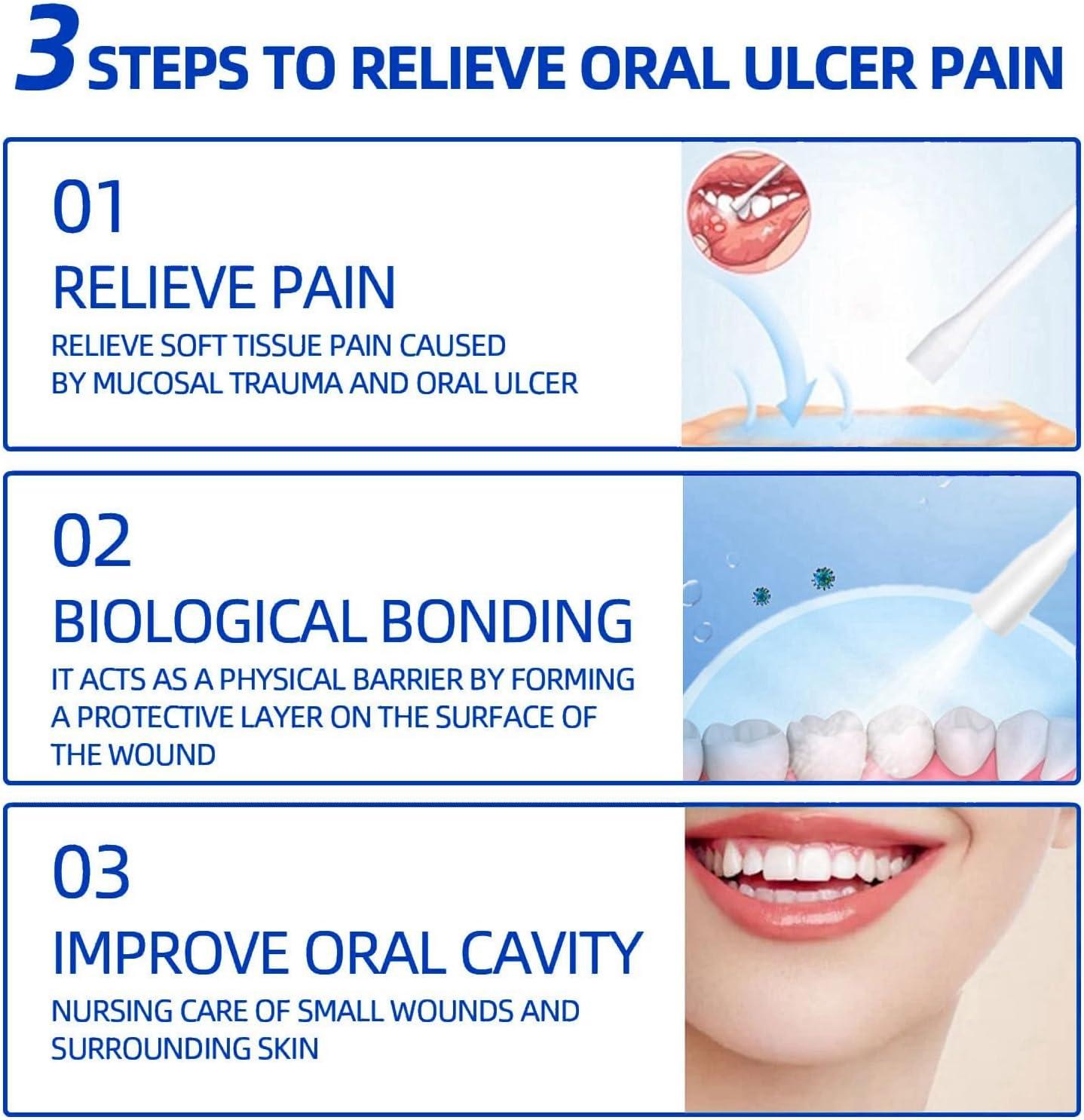 Mouth Ulcer Spray Ulcer Breath Sprays Mouth Ulcer Treatment Spray Ulcer ...