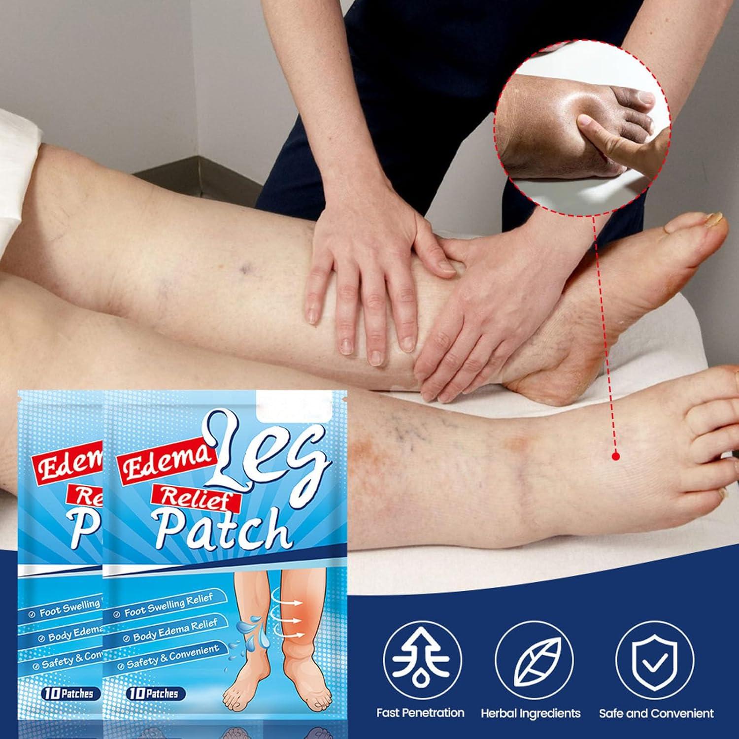 Bone Edema Relief Plasters - 50 Herbal Extract Pieces for Circulatory ...