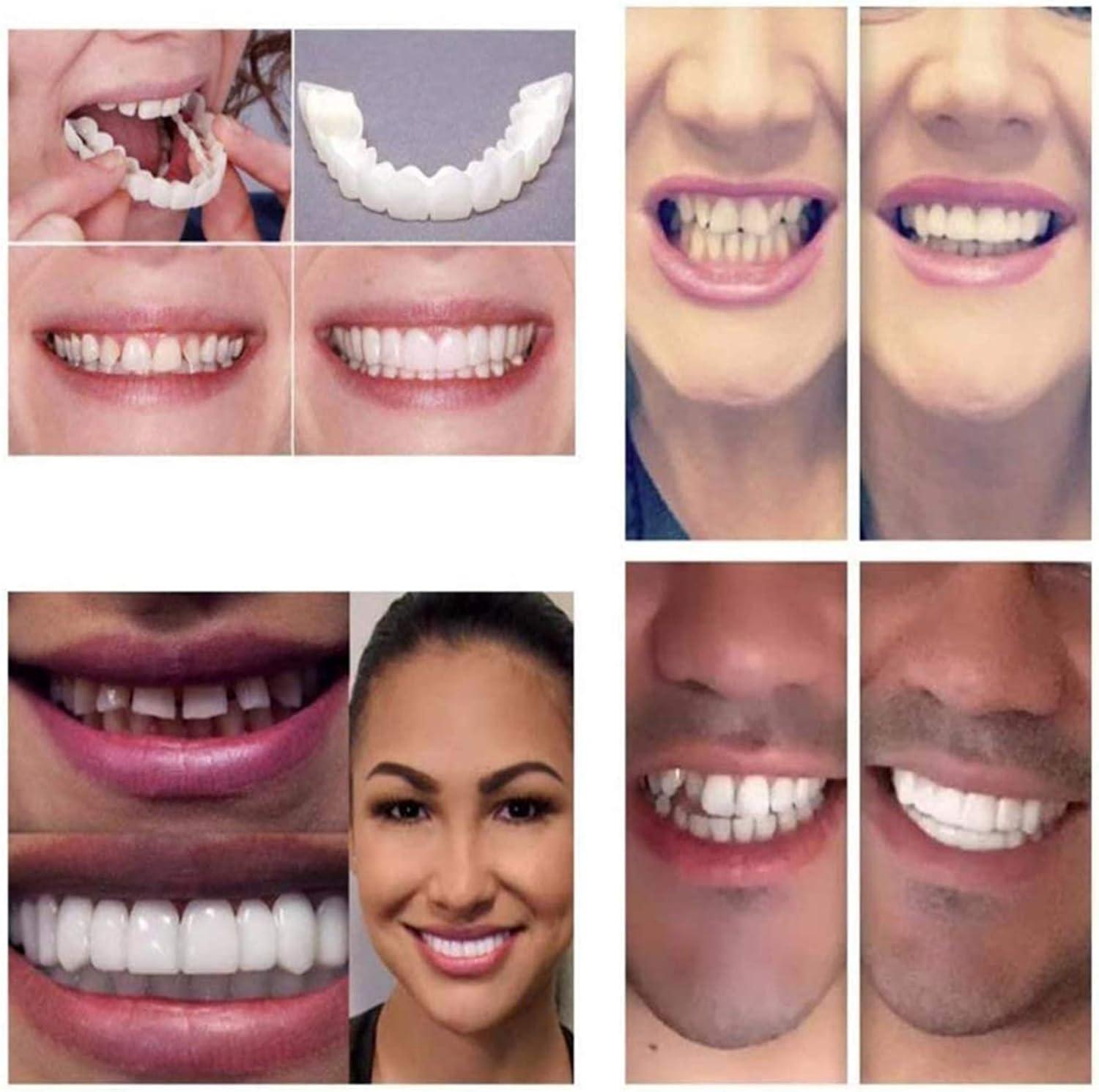 Shop FBite Veneers - Instant Perfect Smile with Provisional Dentures ...