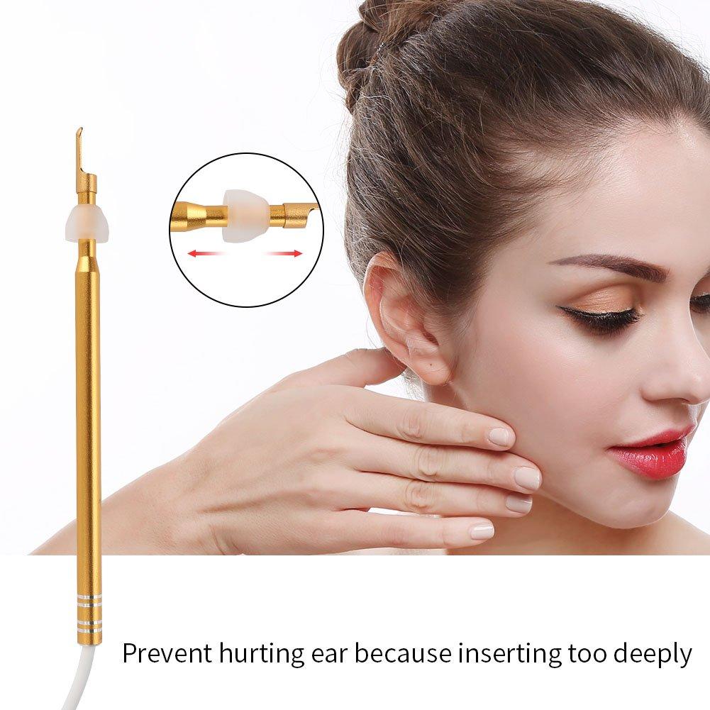 3-in-1 Earwax Removal Kit with Endoscope | Ear Pick & Cleaner | HD ...