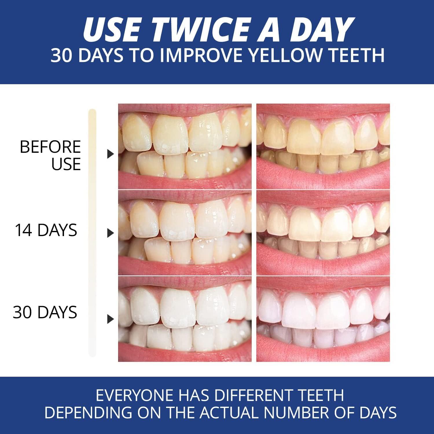 Teeth Whitening Pen 4 Pack, Brighten Your Smile in Just 1 Week with ...