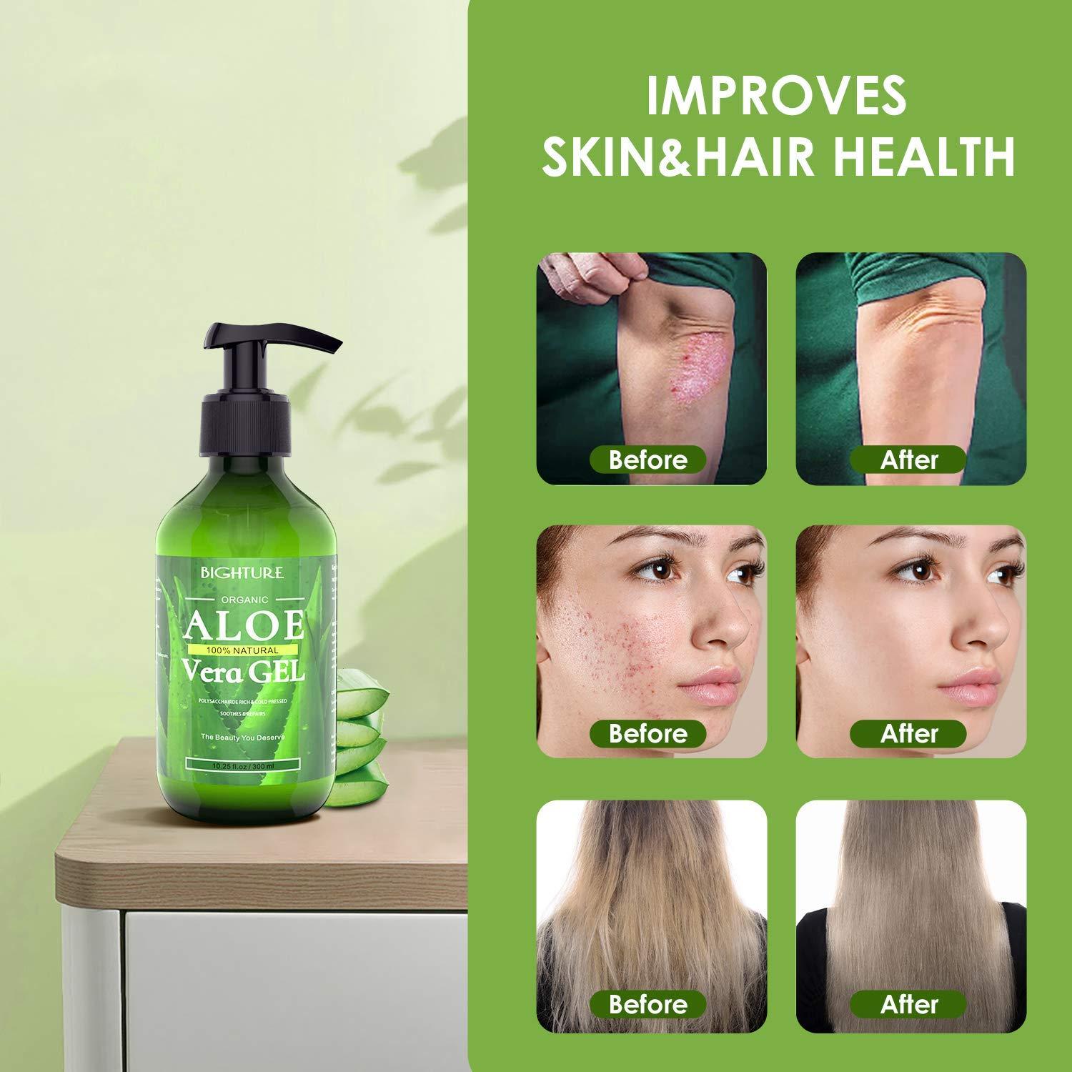 Bighture Aloe Vera Gel 100 Aloe Vera Organic From Freshly Cut Aloe