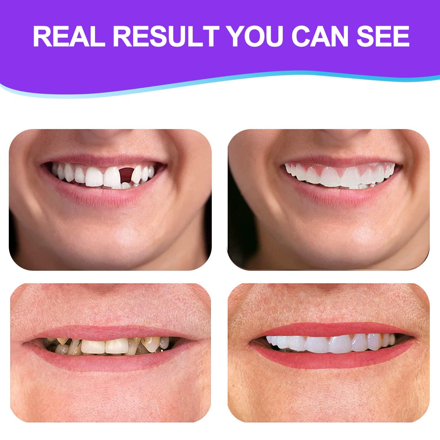 Nature Comfort Fake Teeth Set: Upper & Lower Dentures for Confident ...