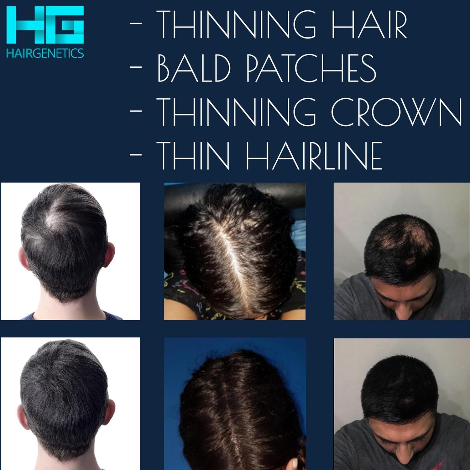 Hair Genetics Advanced Keratin Hair Building Fibres - Medium Brown 50g ...