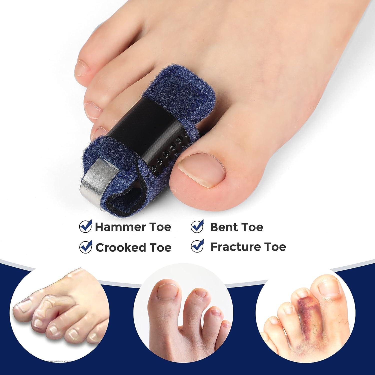 Ajoysoul Toe Splint 1 Pair Toe Straightener for Bent Toe Hammer Toe ...