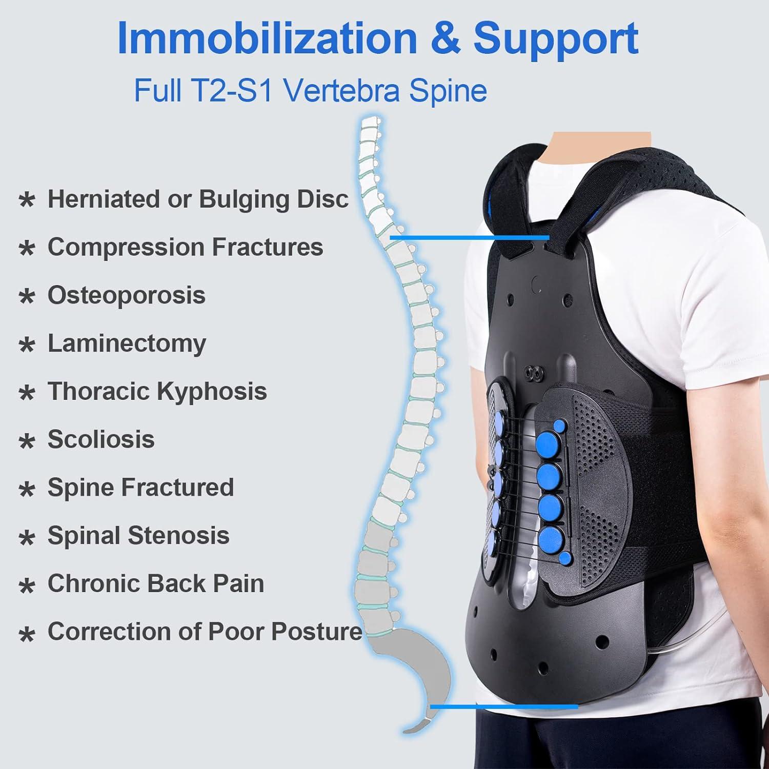 Nvorliy TLSO Back Brace - Inflatable Decompression Support for Compression Fractures Kyphosis ...